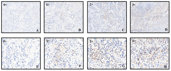 Association Between Phosphorylated AXL Expression and Survival in ...