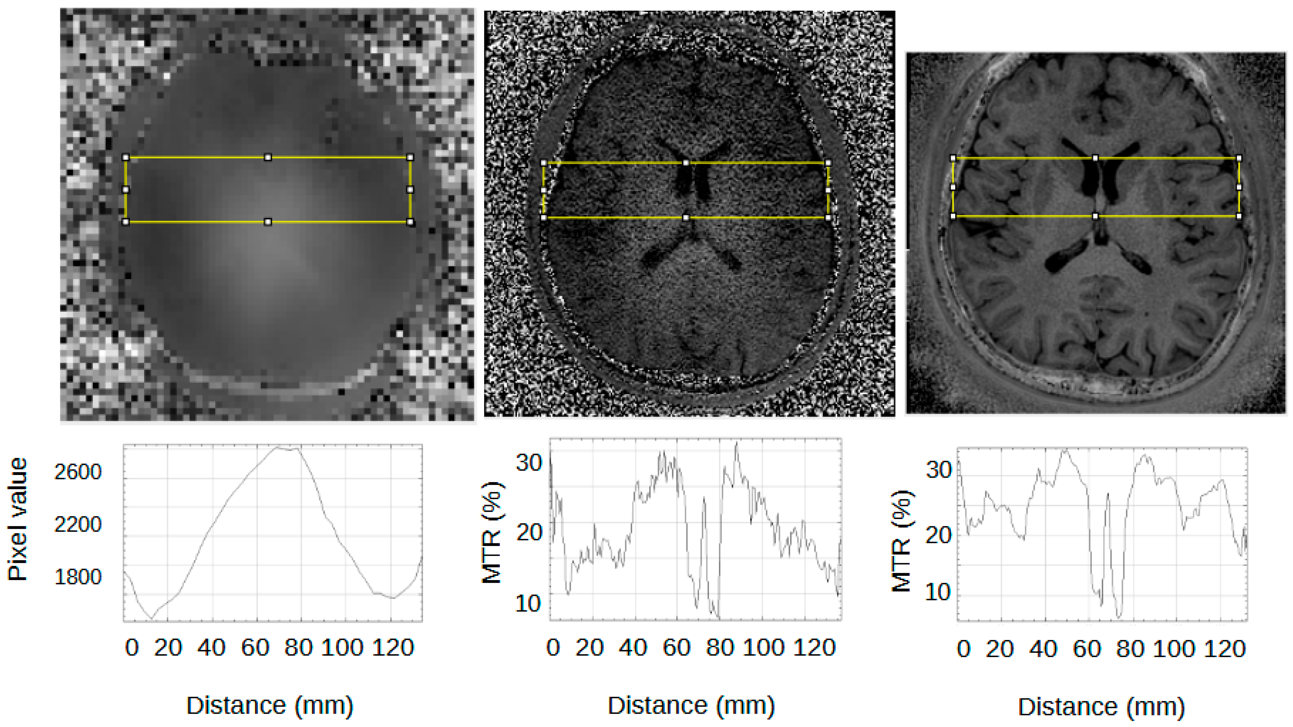 Magnetisation Transfer 3D-Radial Zero Echo Time MR Imaging at 7T