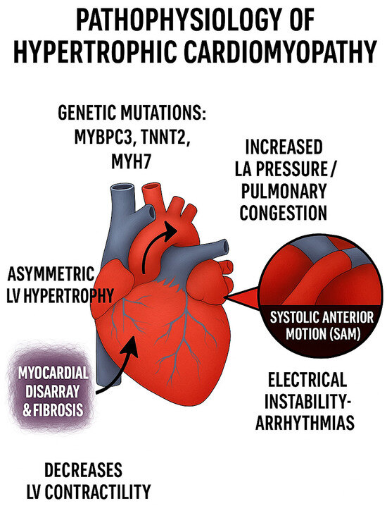 Mavacamten for Obstructive Hypertrophic Cardiomyopathy: Targeting ...