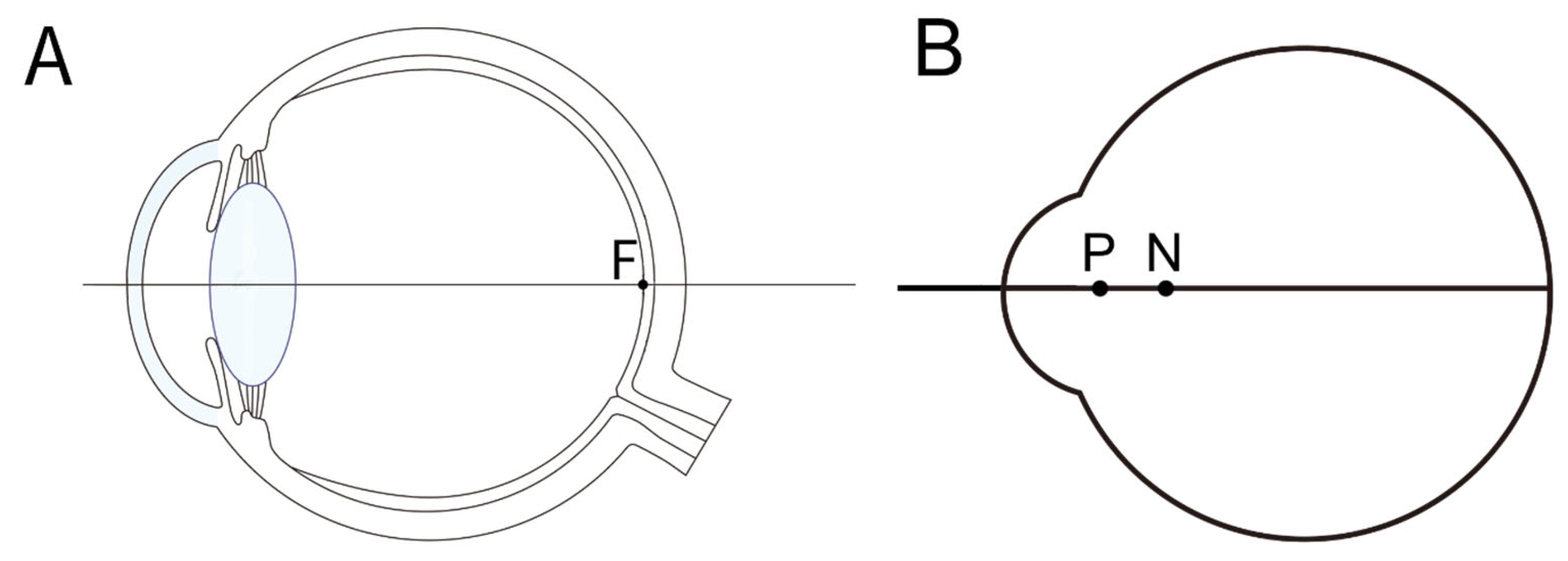 Basic Optics Underlying Current Intraocular Lenses
