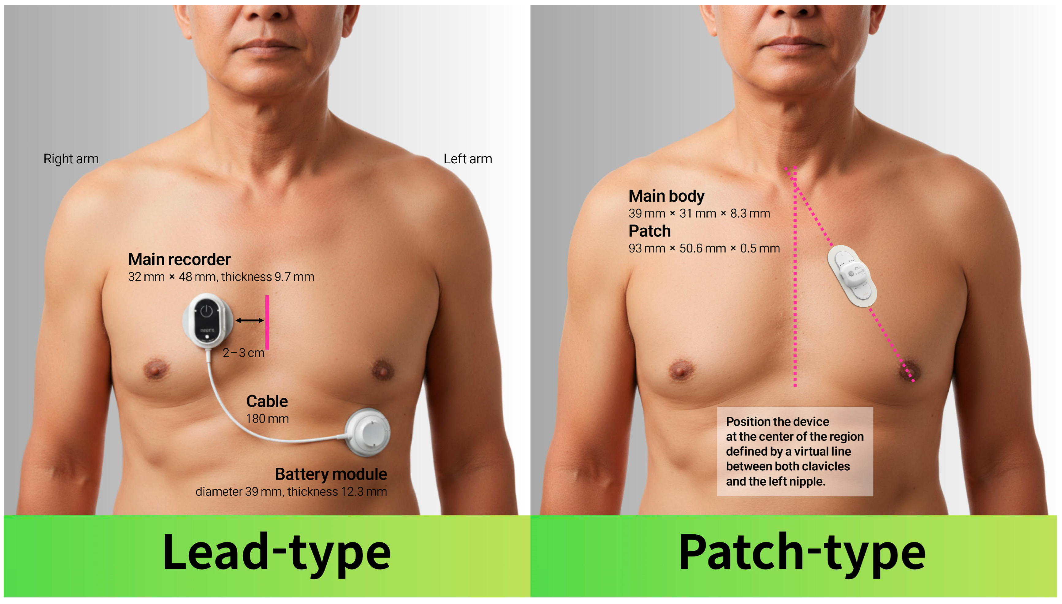 Comparative Performance of Patch-Type and Lead-Type Wearable ...