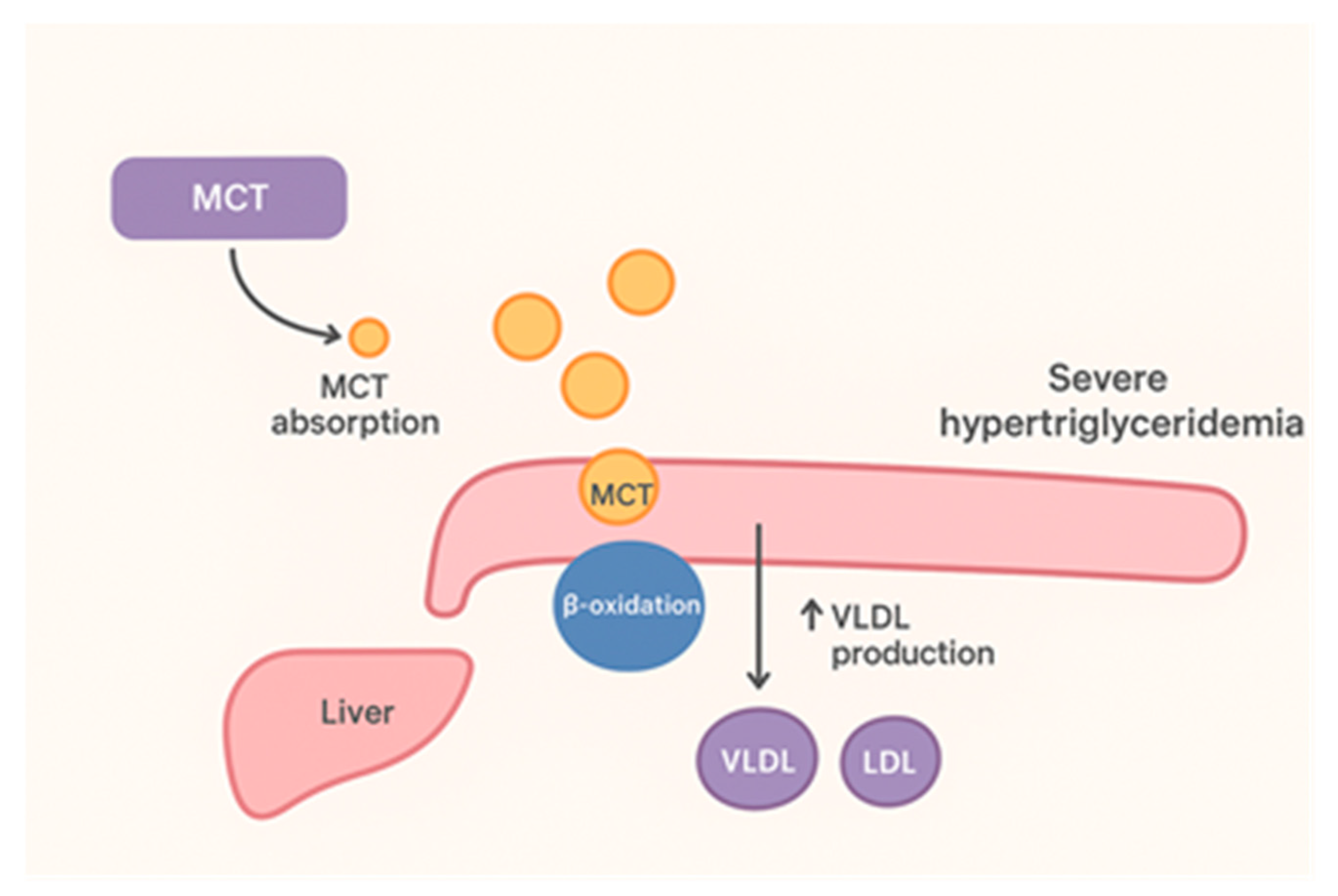 Multimodal Management of Extreme Hypertriglyceridemia in a Child with ...