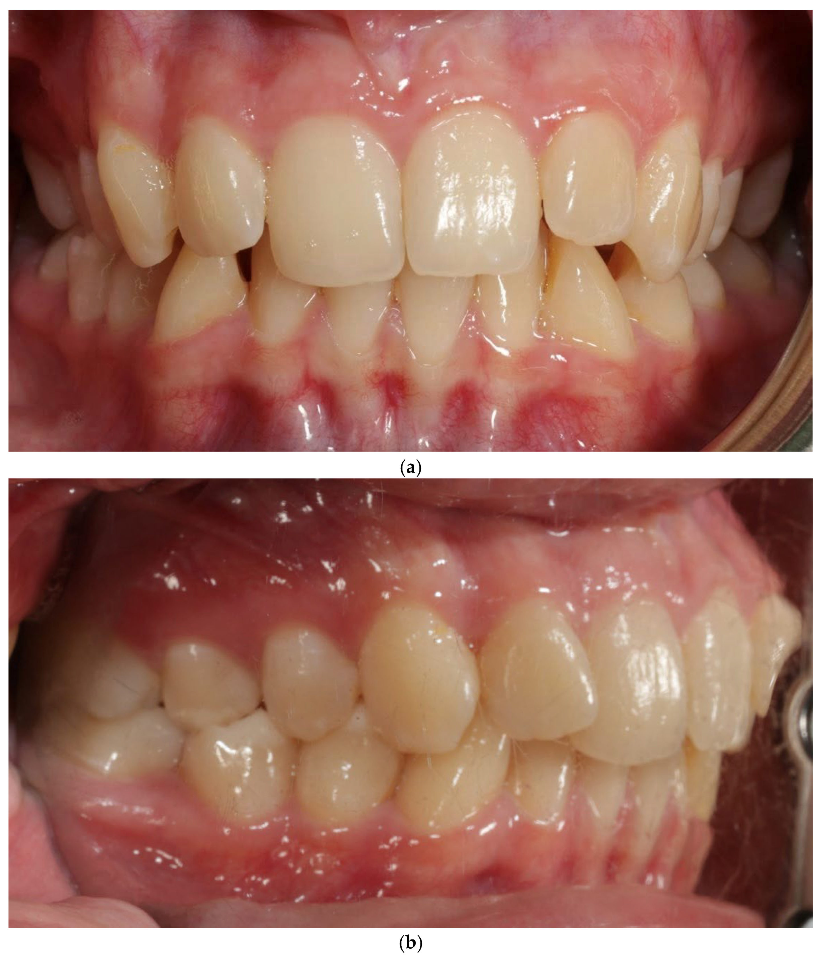 Clinical Soft Tissue Adaptation to Biomechanical Modulation with the ...