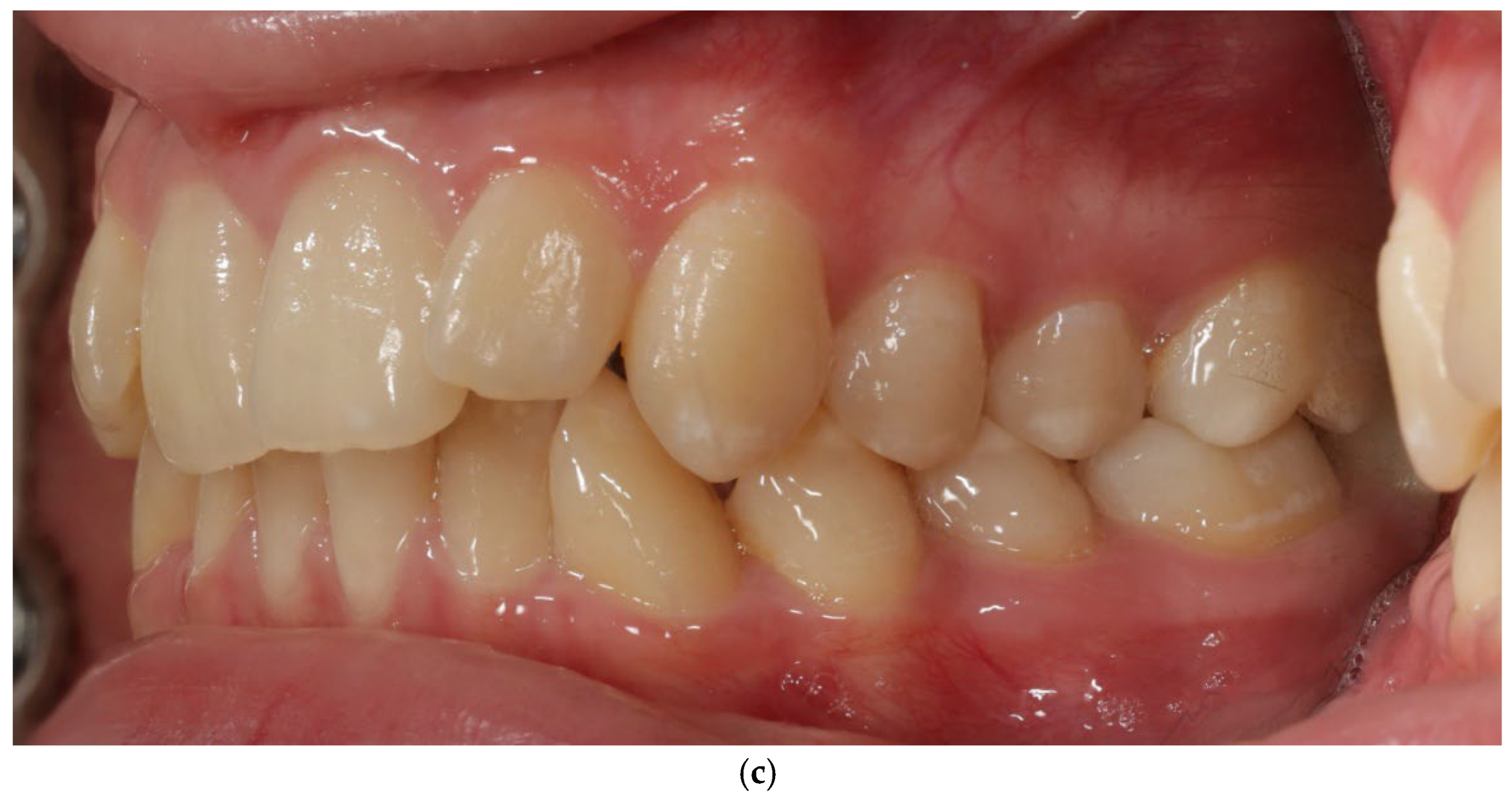 Clinical Soft Tissue Adaptation to Biomechanical Modulation with the ...