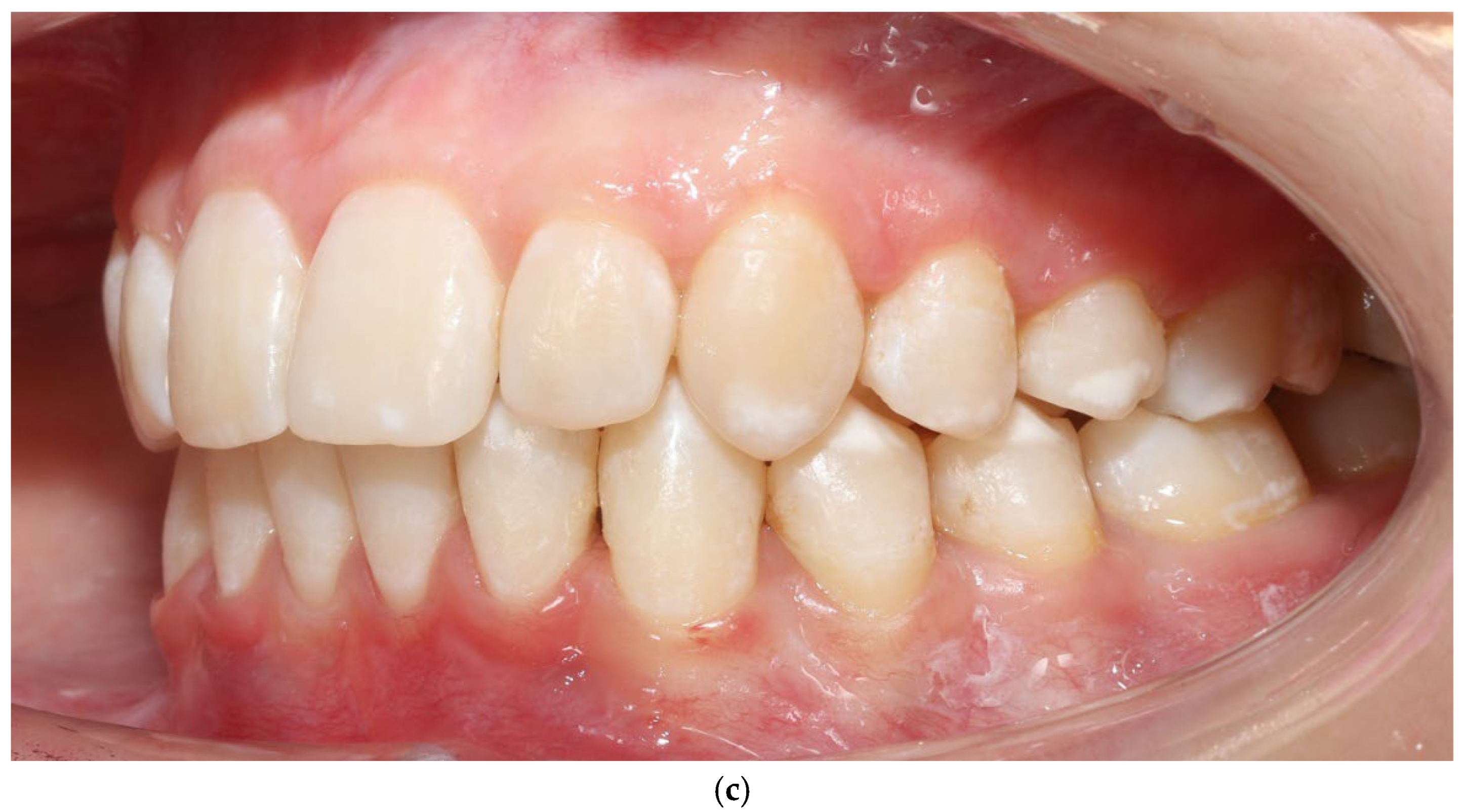 Clinical Soft Tissue Adaptation to Biomechanical Modulation with the ...