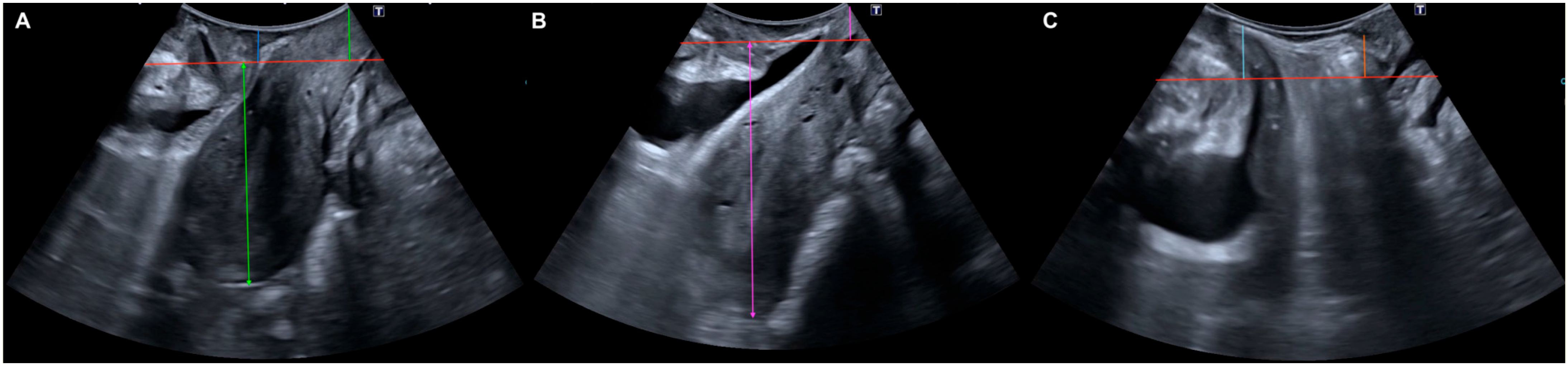 Improving Diagnostic Accuracy for Surgical Pelvic Organ Prolapse: A ...