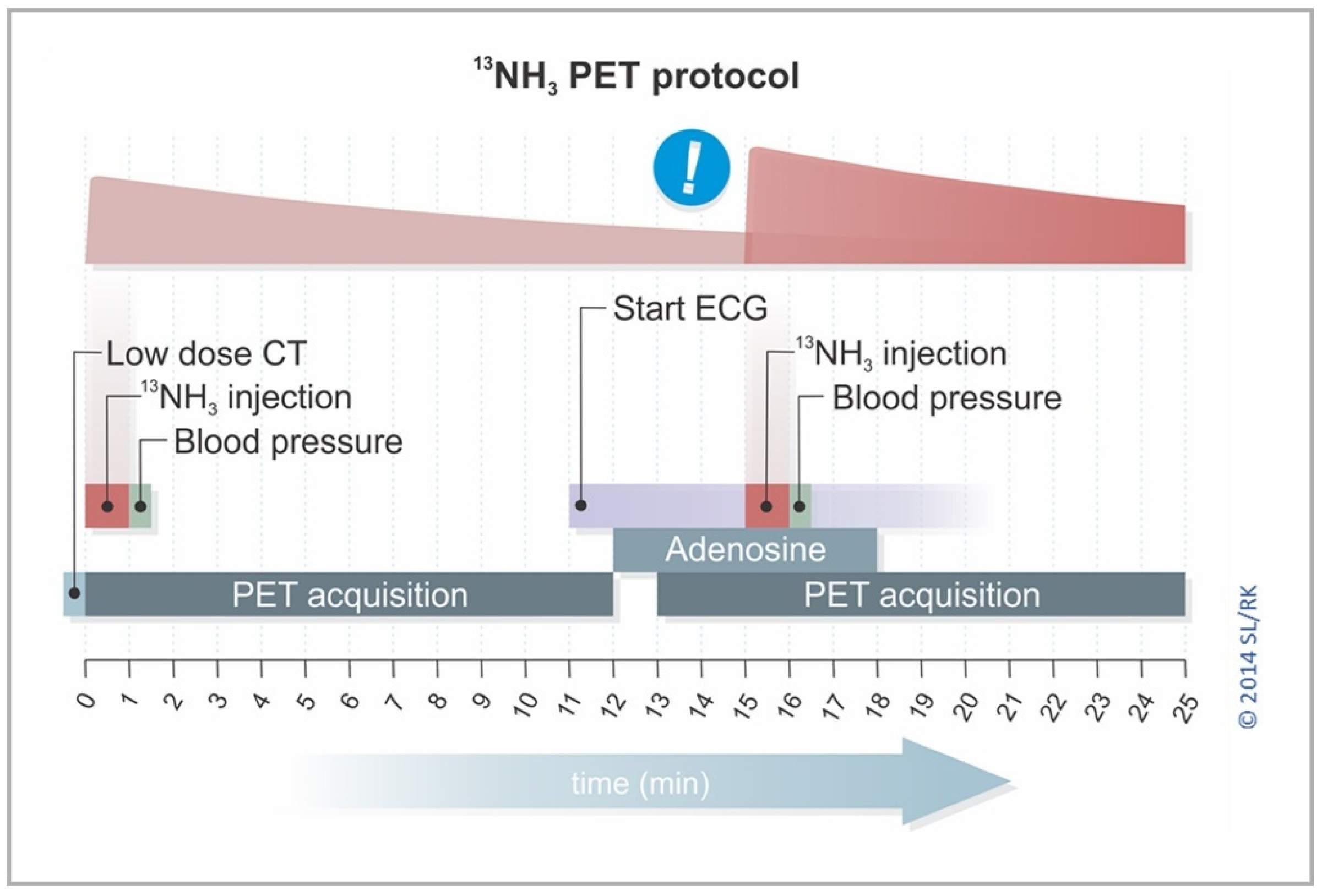 Data-Driven Motion Correction Algorithm: Validation in [13N]NH3 Dynamic ...