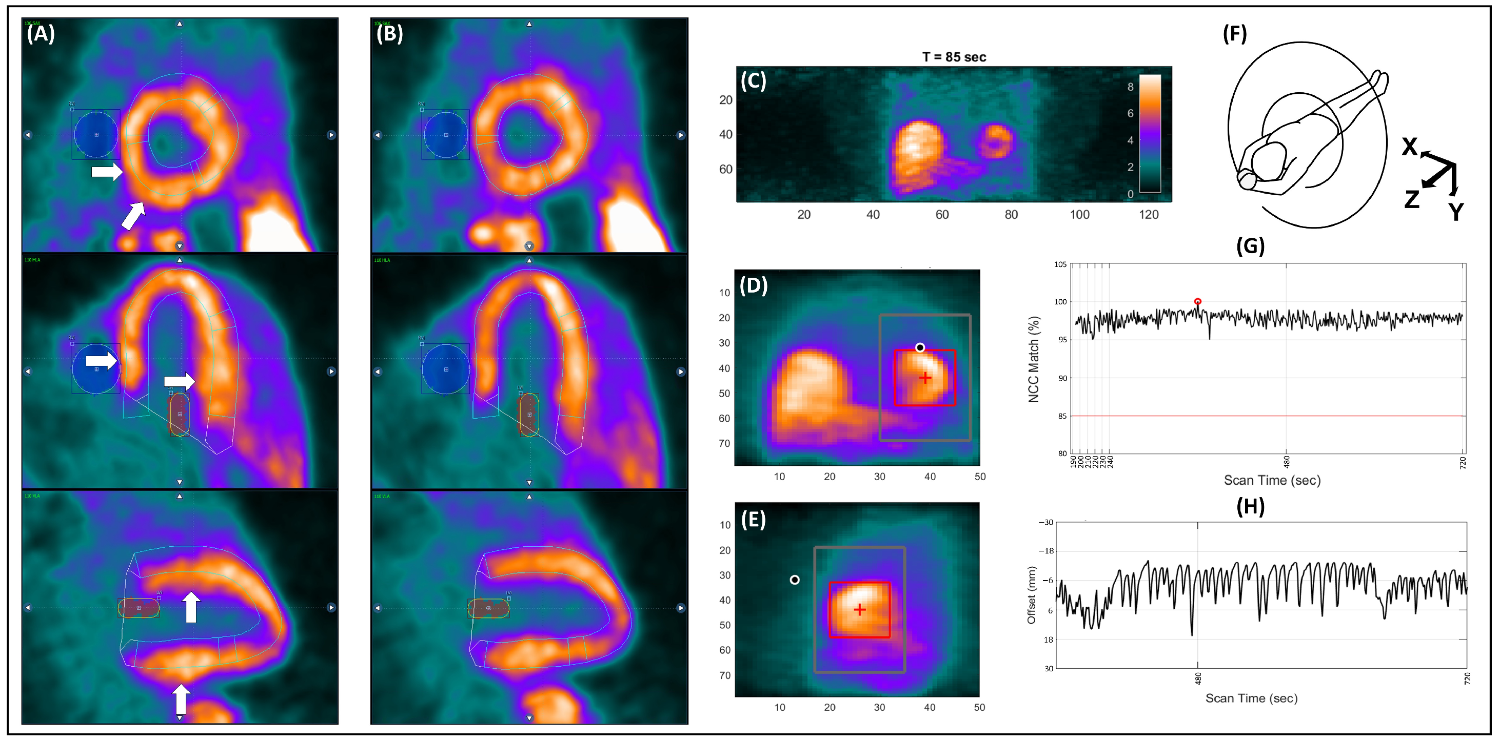 Data-Driven Motion Correction Algorithm: Validation in [13N]NH3 Dynamic ...