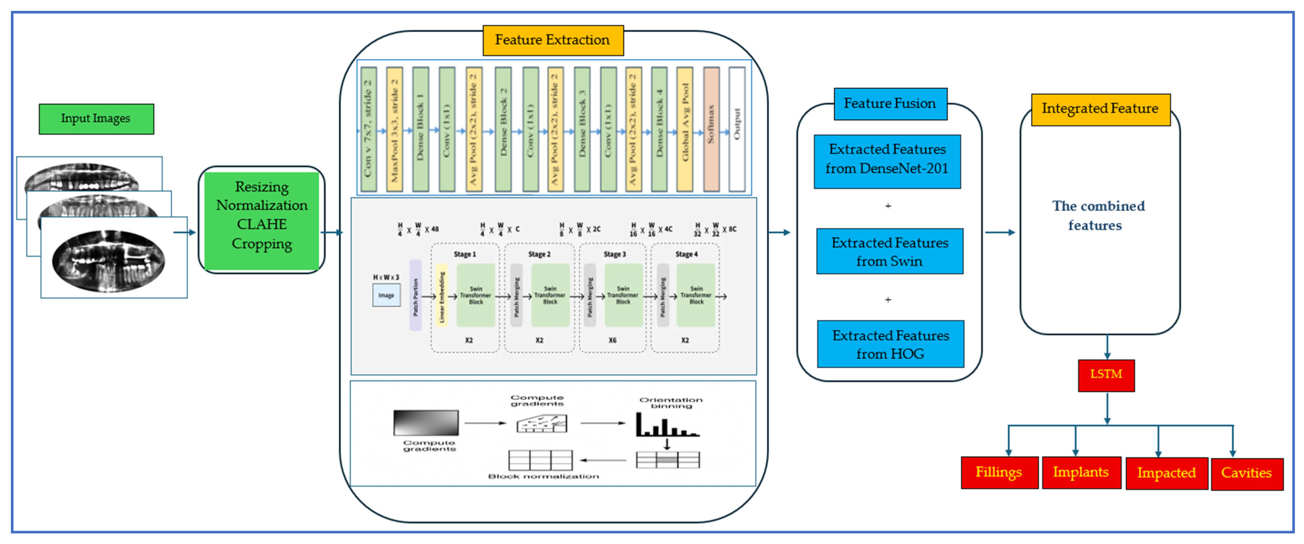A Hybrid Deep Learning Framework for Automated Dental Disorder ...