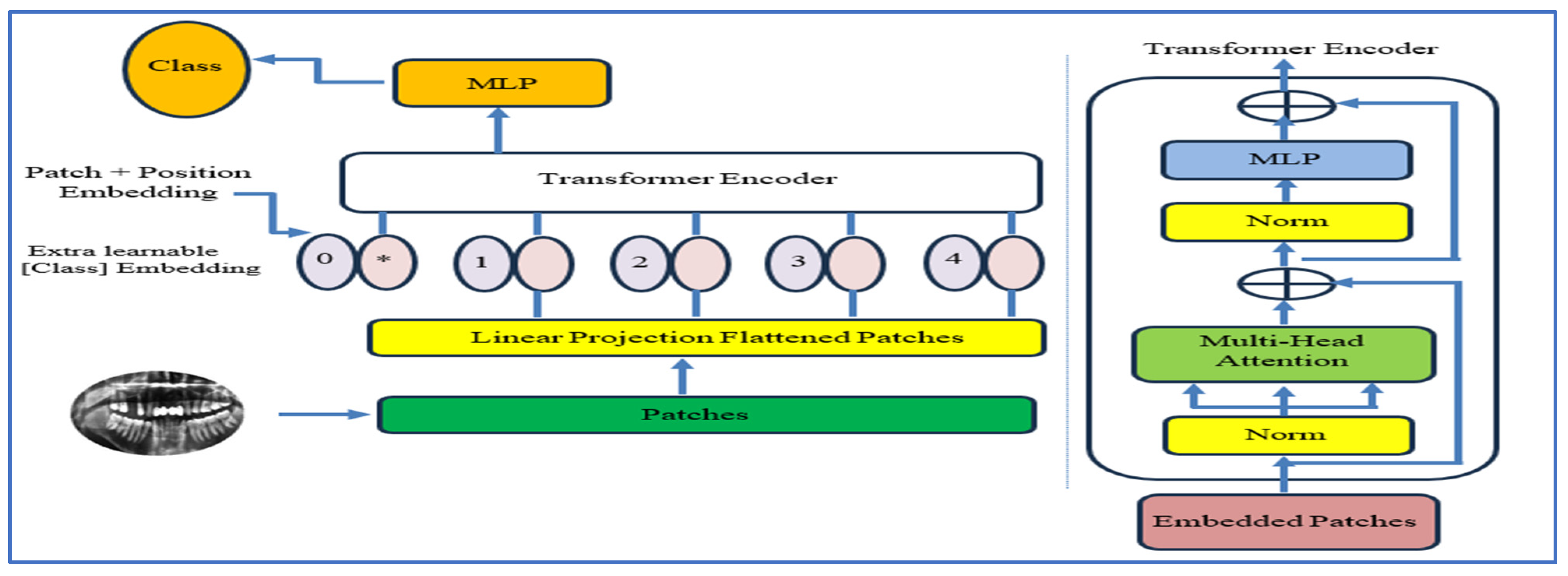 A Hybrid Deep Learning Framework for Automated Dental Disorder ...
