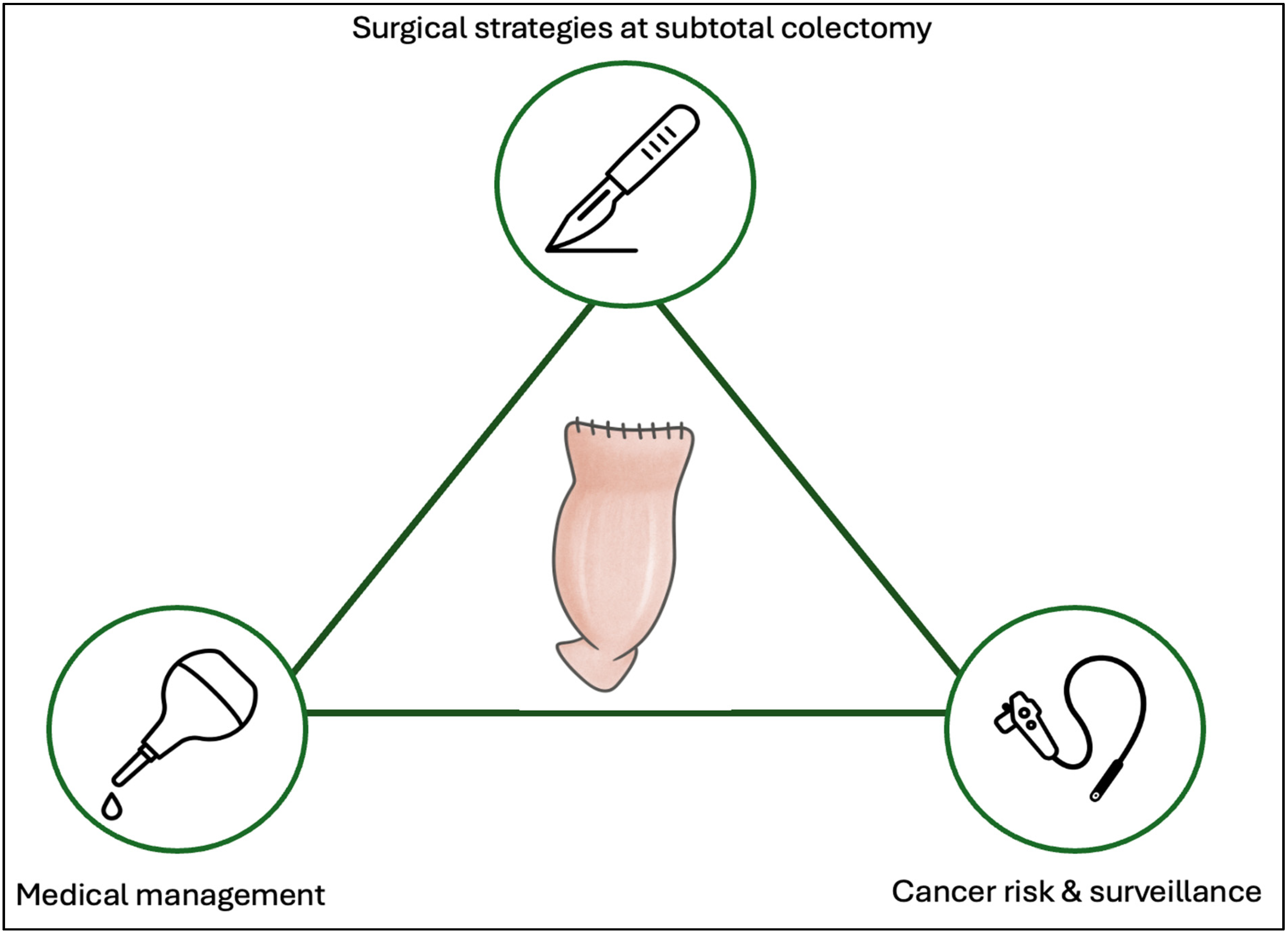 The Rectal Stump During and After Subtotal Colectomy for Ulcerative ...