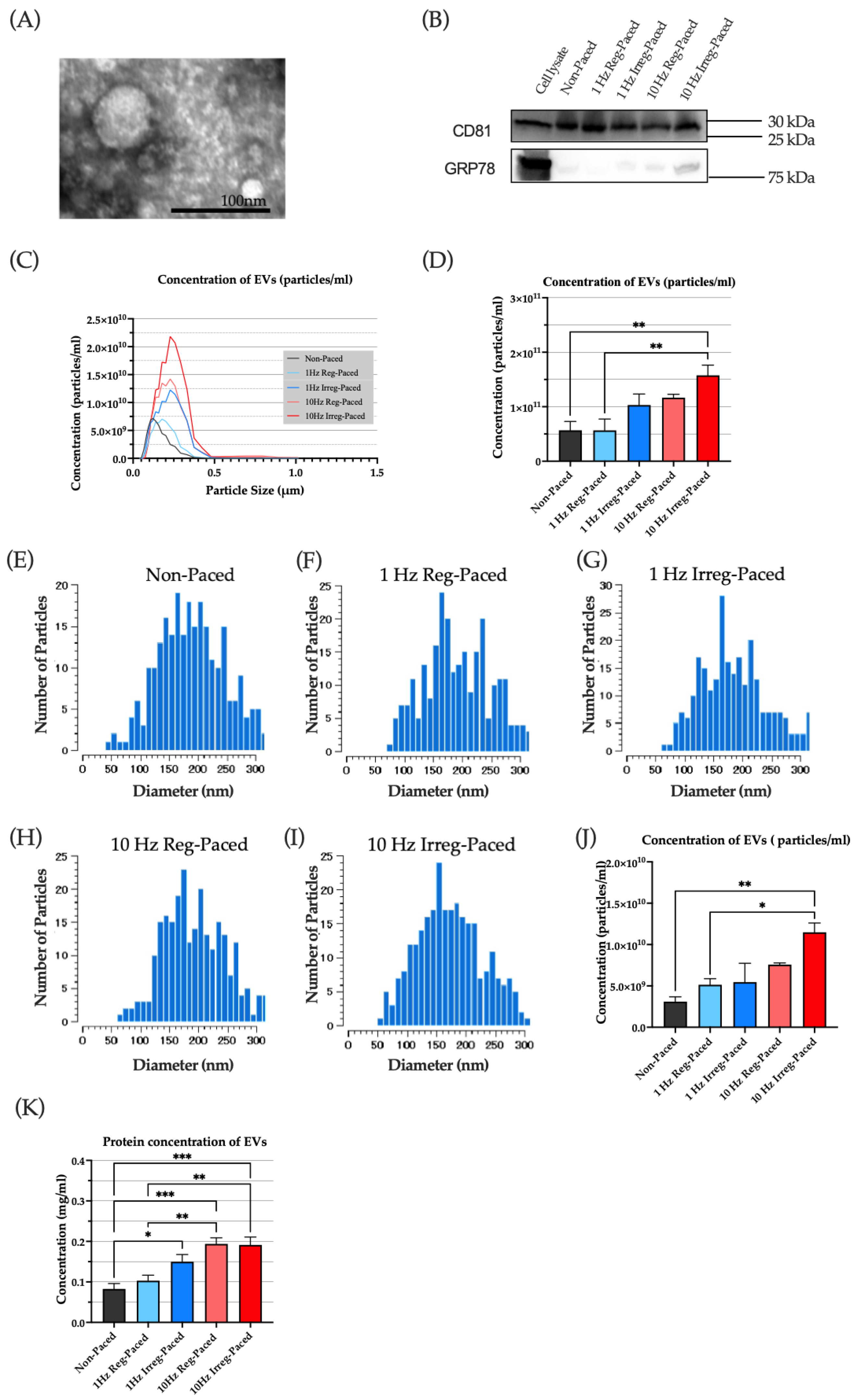 Circulating Extracellular Vesicles Downregulate NOS3 Expression in ...