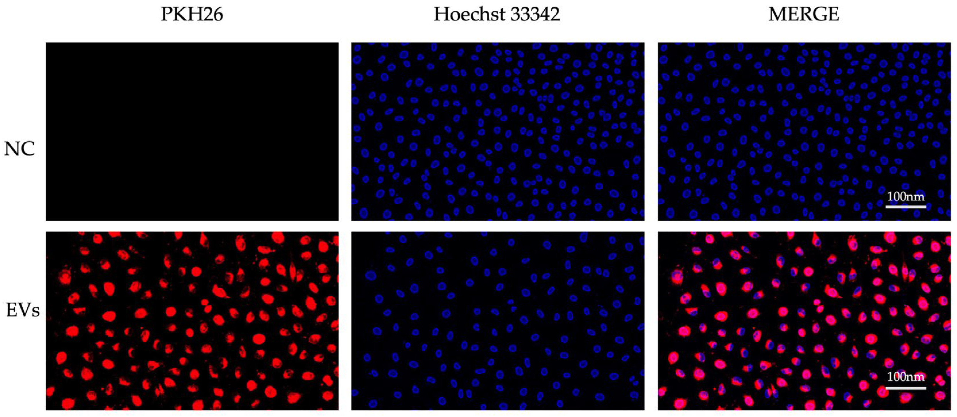 Circulating Extracellular Vesicles Downregulate NOS3 Expression in ...