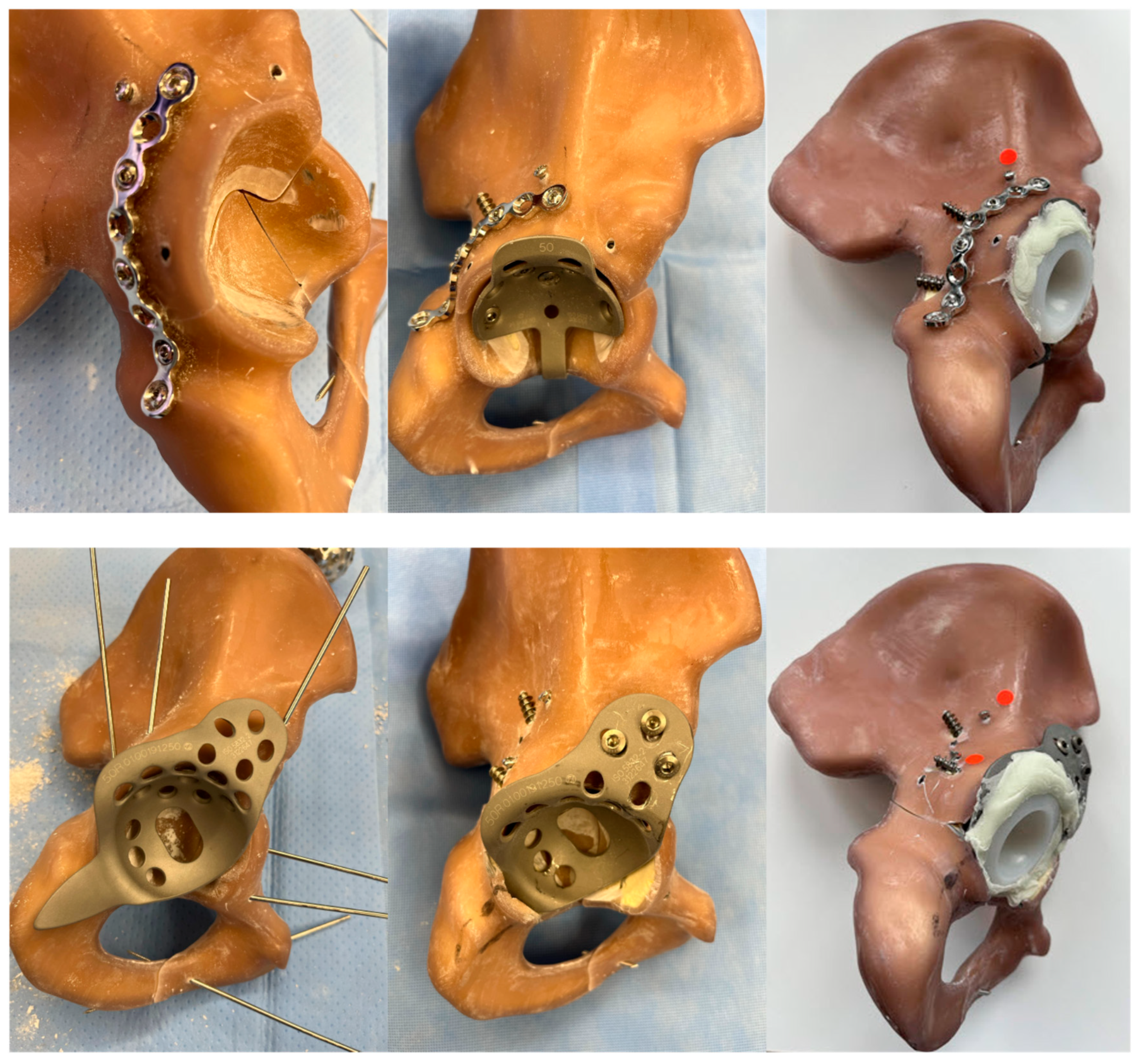Comparison of the Biomechanical Stability of Two Fix-and-Replace ...