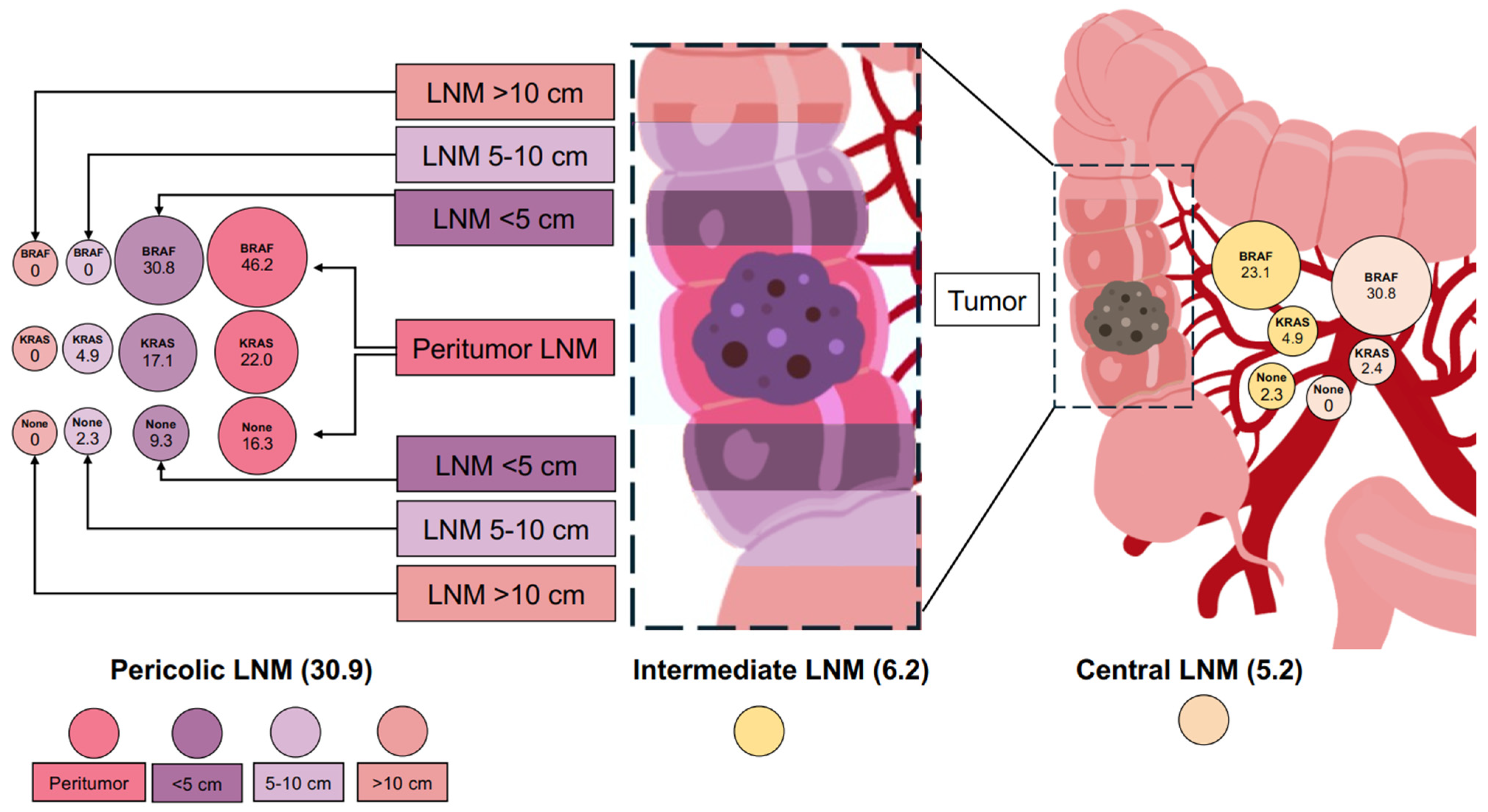 Increased Risk of Central Mesocolic Lymph Node Metastases in BRAF ...