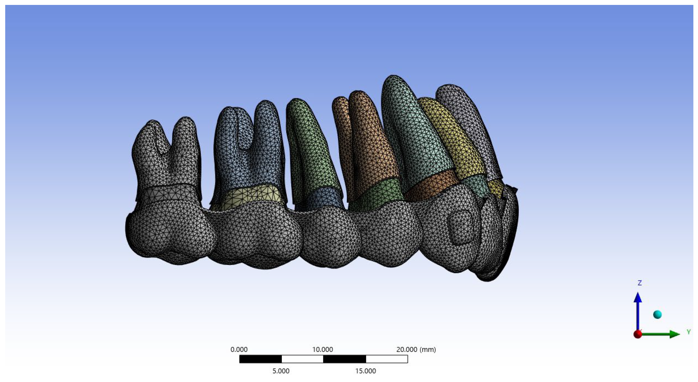 Effects of Attachment Placement on Palatal Root Torque Control of ...