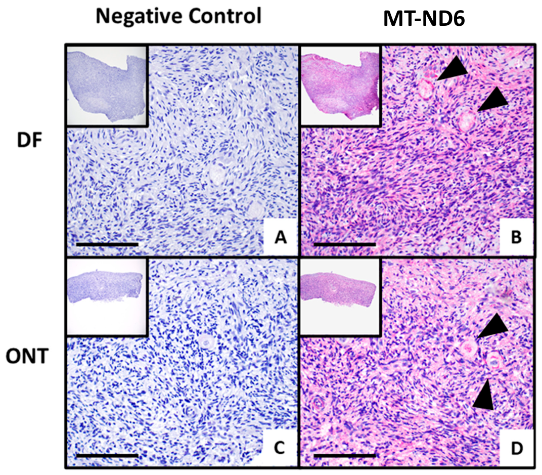 Transport Time Does Not Substantially Alter RNA Expression in Human ...
