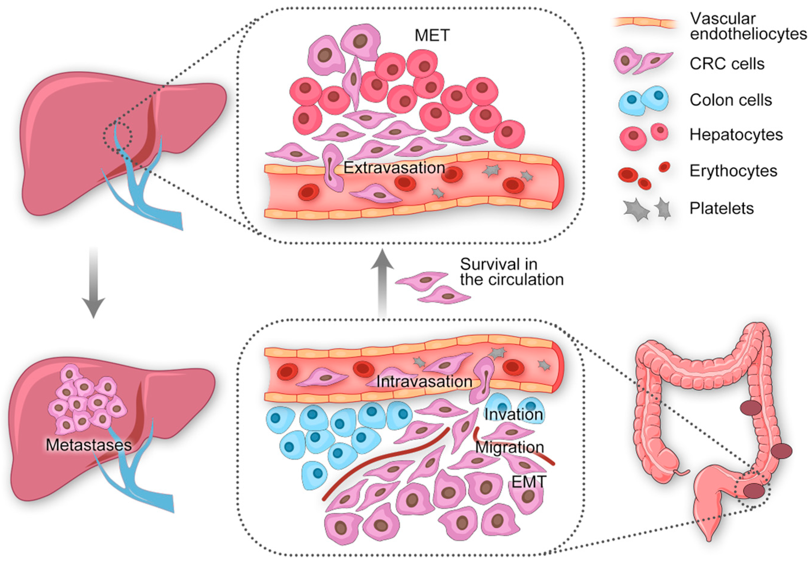 Critical Prognostic and Predictive Factors in Colorectal Liver ...