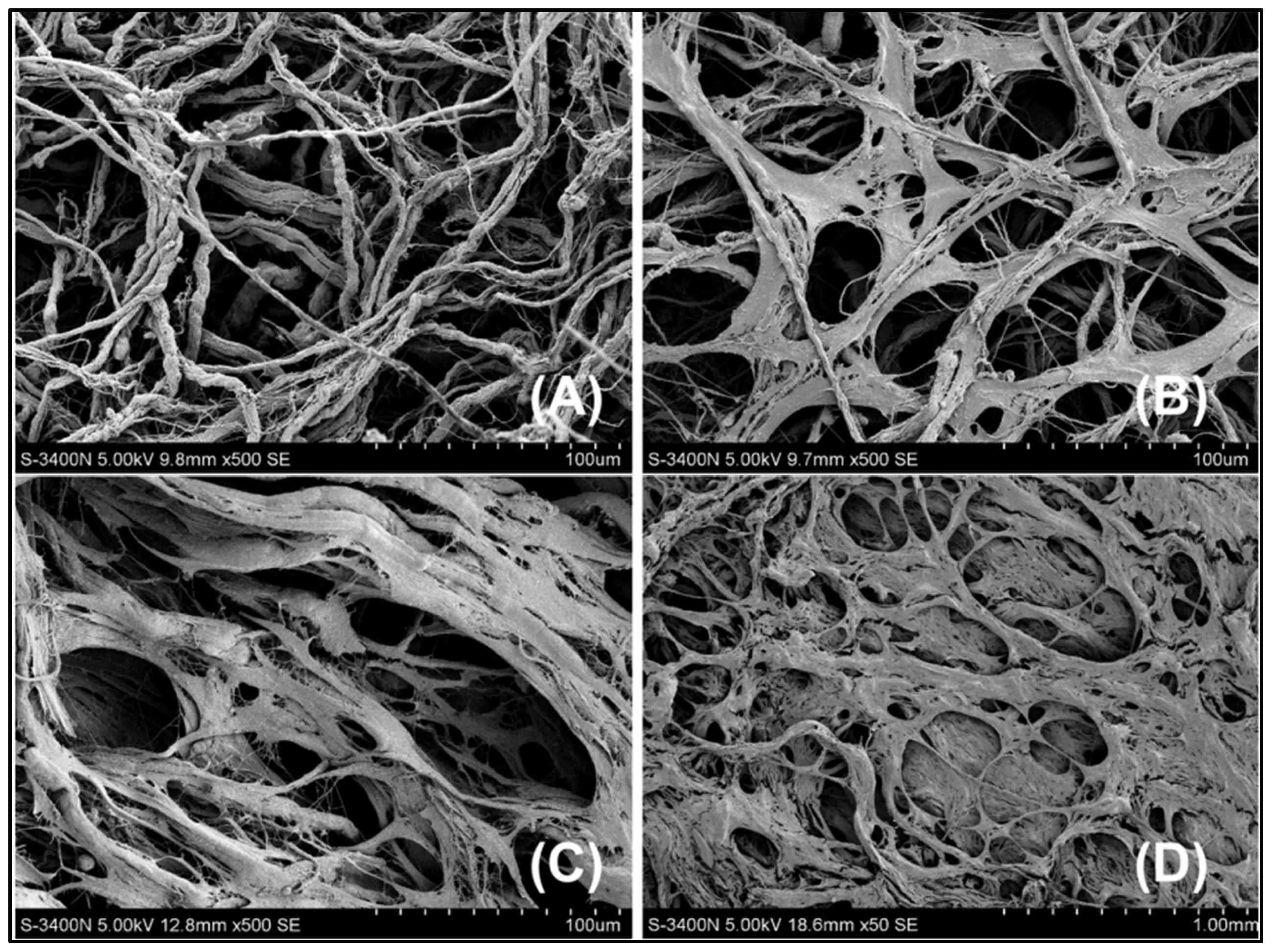 Advances and Challenges in Tissue Engineering: Biomaterials, Cellular ...