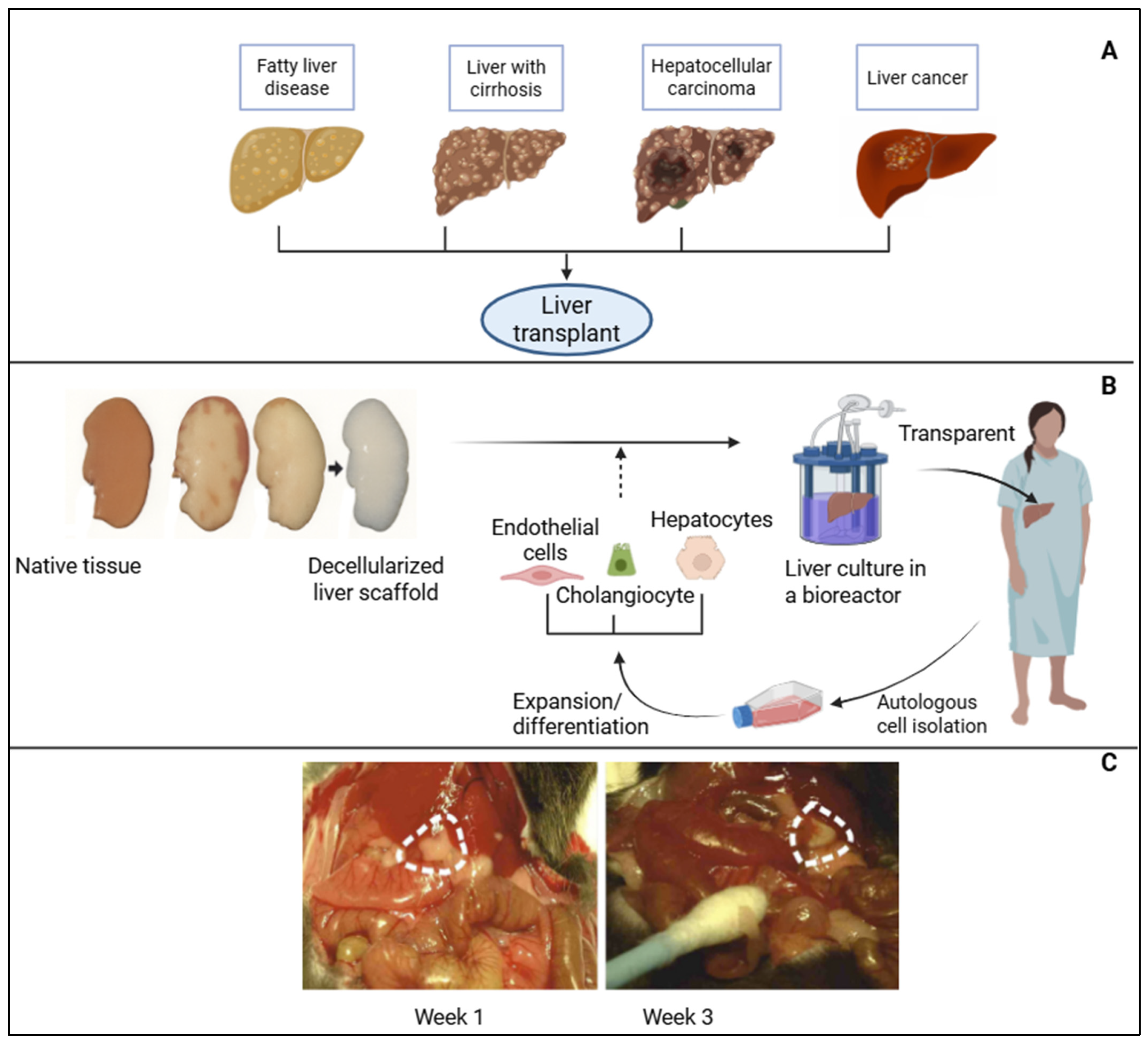 Advances and Challenges in Tissue Engineering: Biomaterials, Cellular ...