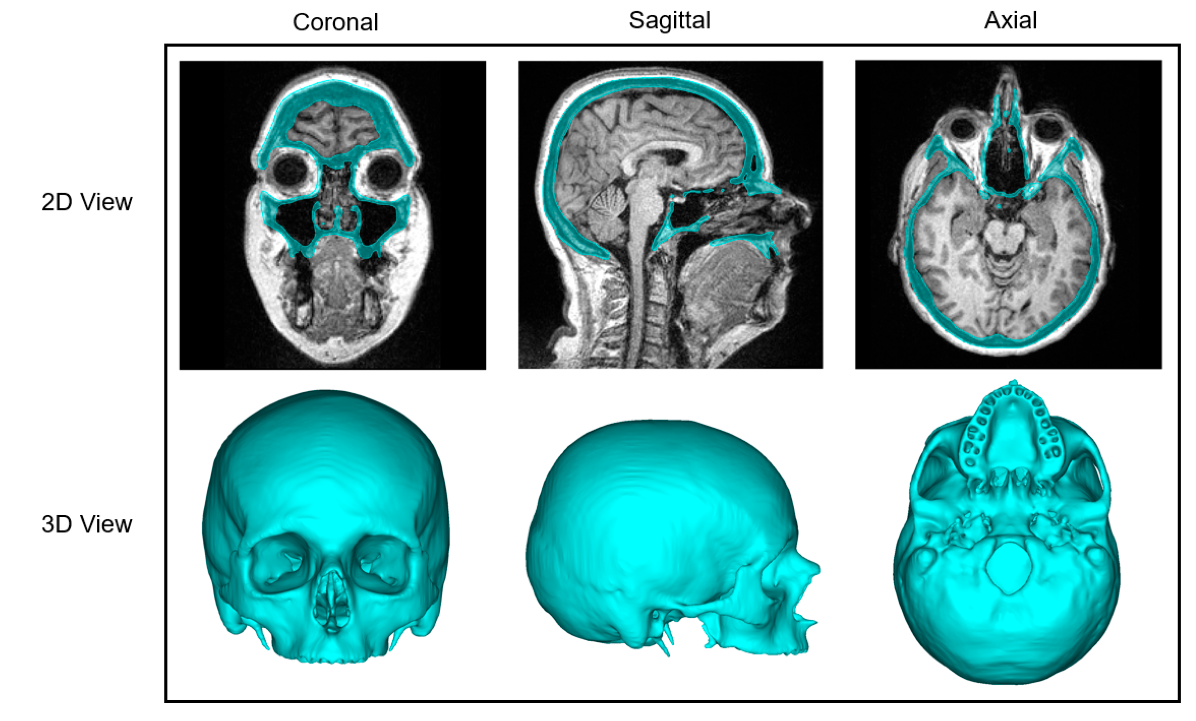 Redefining MRI-Based Skull Segmentation Through AI-Driven Multimodal ...