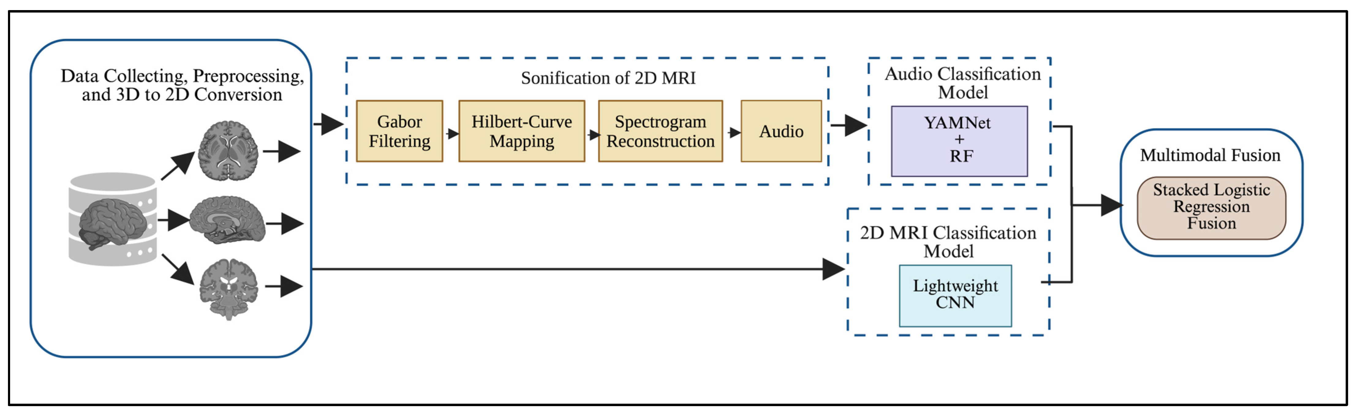 A Dual Stream Deep Learning Framework for Alzheimer’s Disease Detection ...