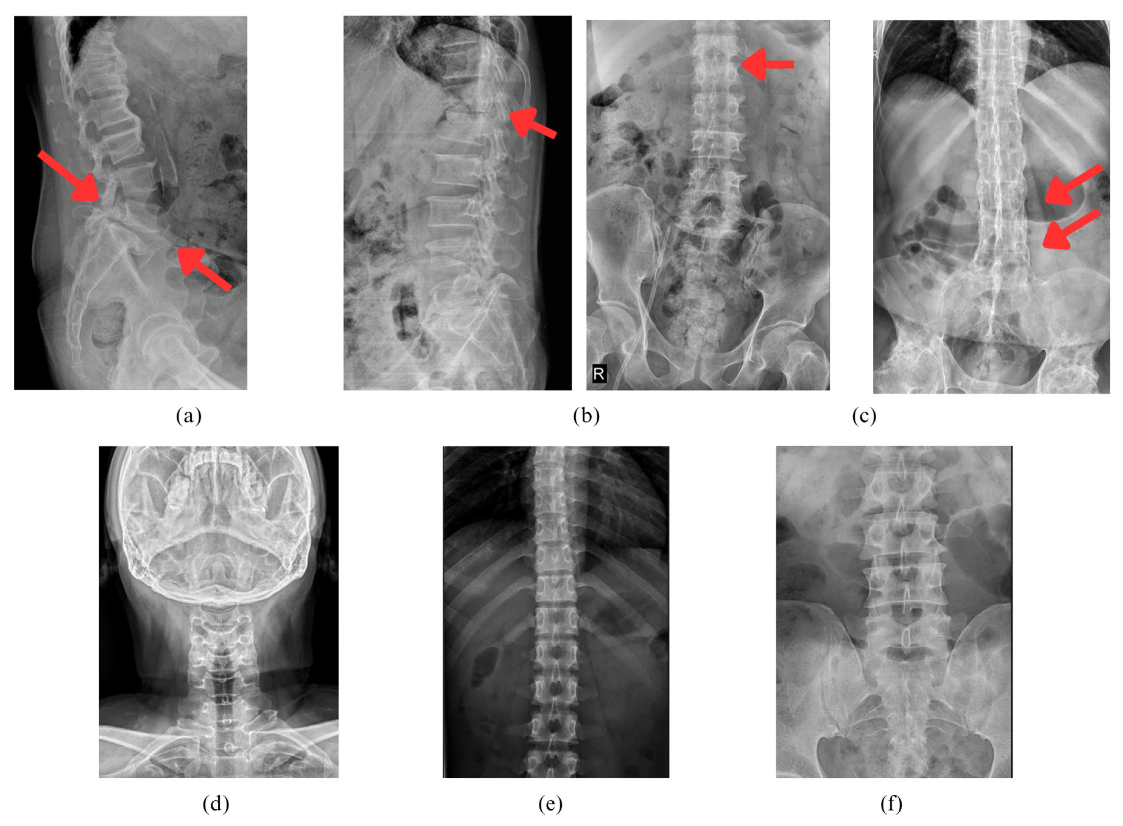 Neuro-Geometric Graph Transformers with Differentiable Radiographic ...