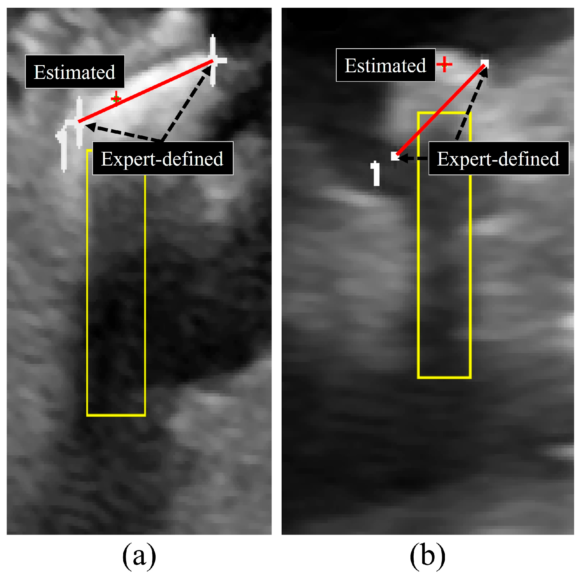 A Robust Rule-Based Framework for Stone Detection and Posterior ...
