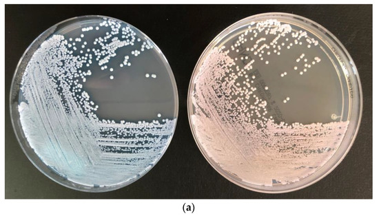 Novel Chromogenic Medium CHROMagarTM Candida Plus for Detection of ...