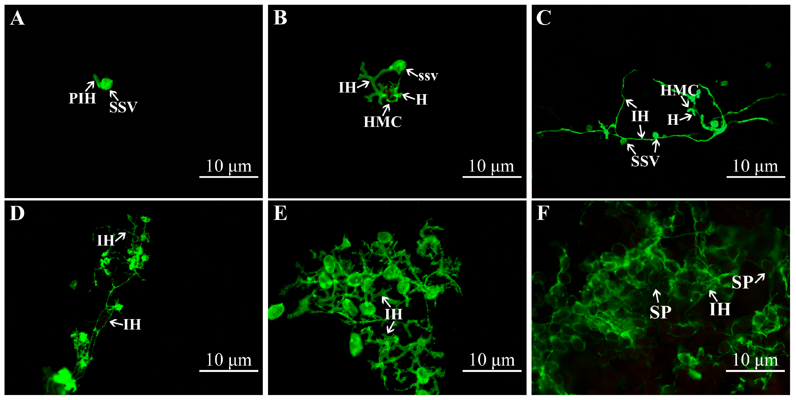 Histopathological and Ultrastructural Observations of Zanthoxylum ...