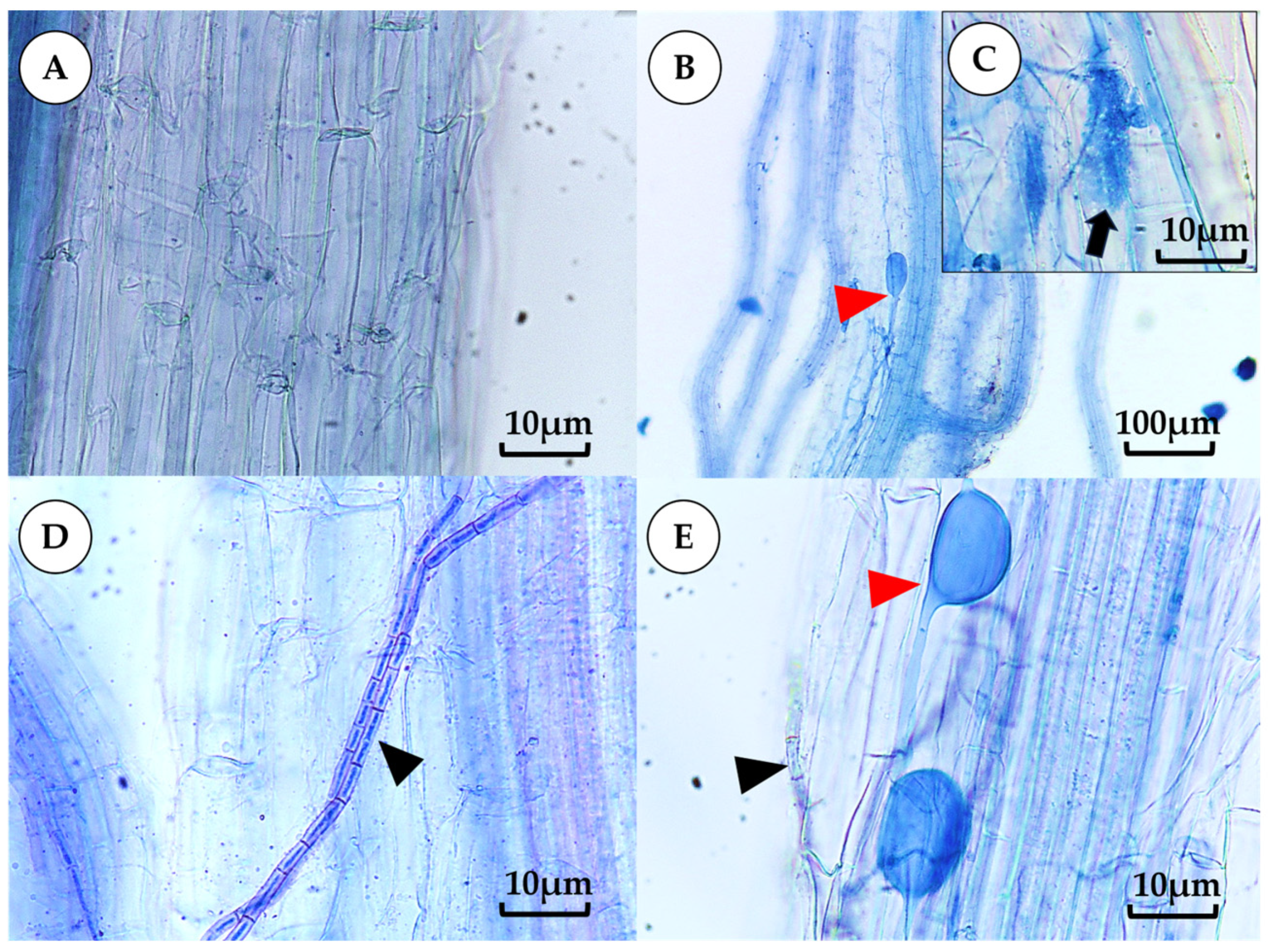 Promoting Growth Performances and Phytochemicals of Black Upland Rice ...