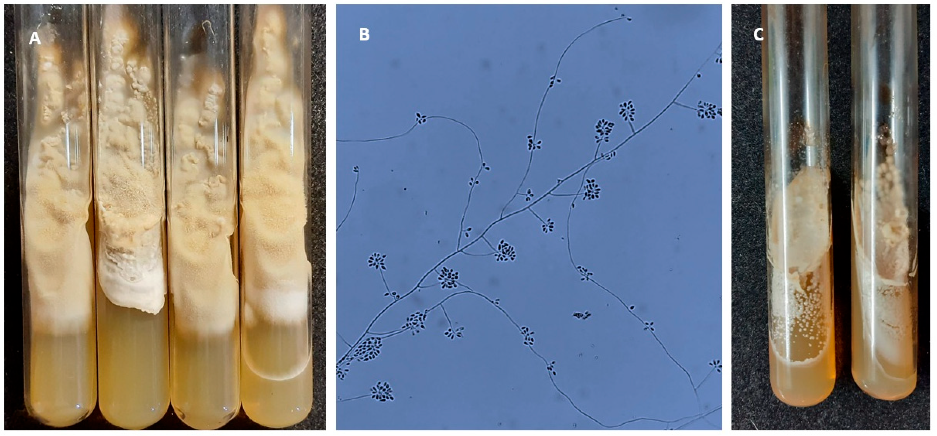 Zoonotic Sporotrichosis by Sporothrix brasiliensis in Chile: Evidence ...
