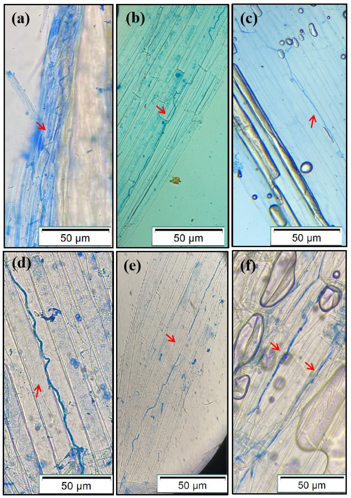 The Compatibility of the Epichloë bromicola–Hordeum Association