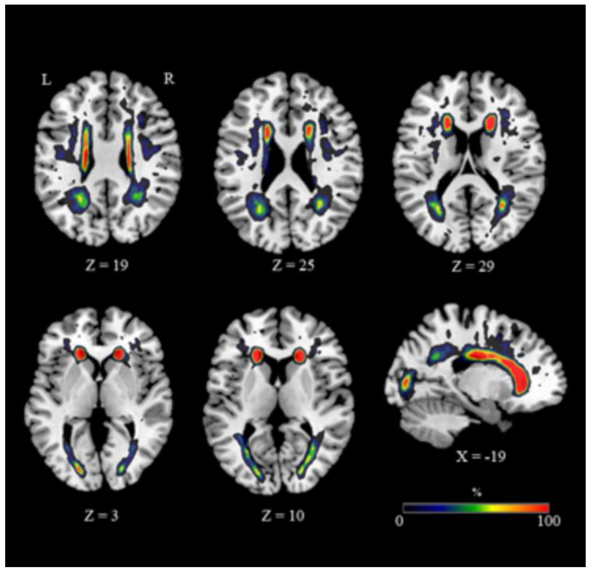 JPM Free Full Text Subclinical Cognitive And Neuropsychiatric JPM Free Full Text Subclinical Cognitive And Neuropsychiatric