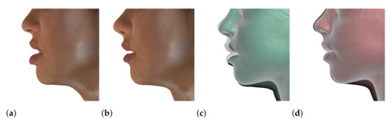 Soft-Tissue Simulation for Computational Planning of Orthognathic Surgery
