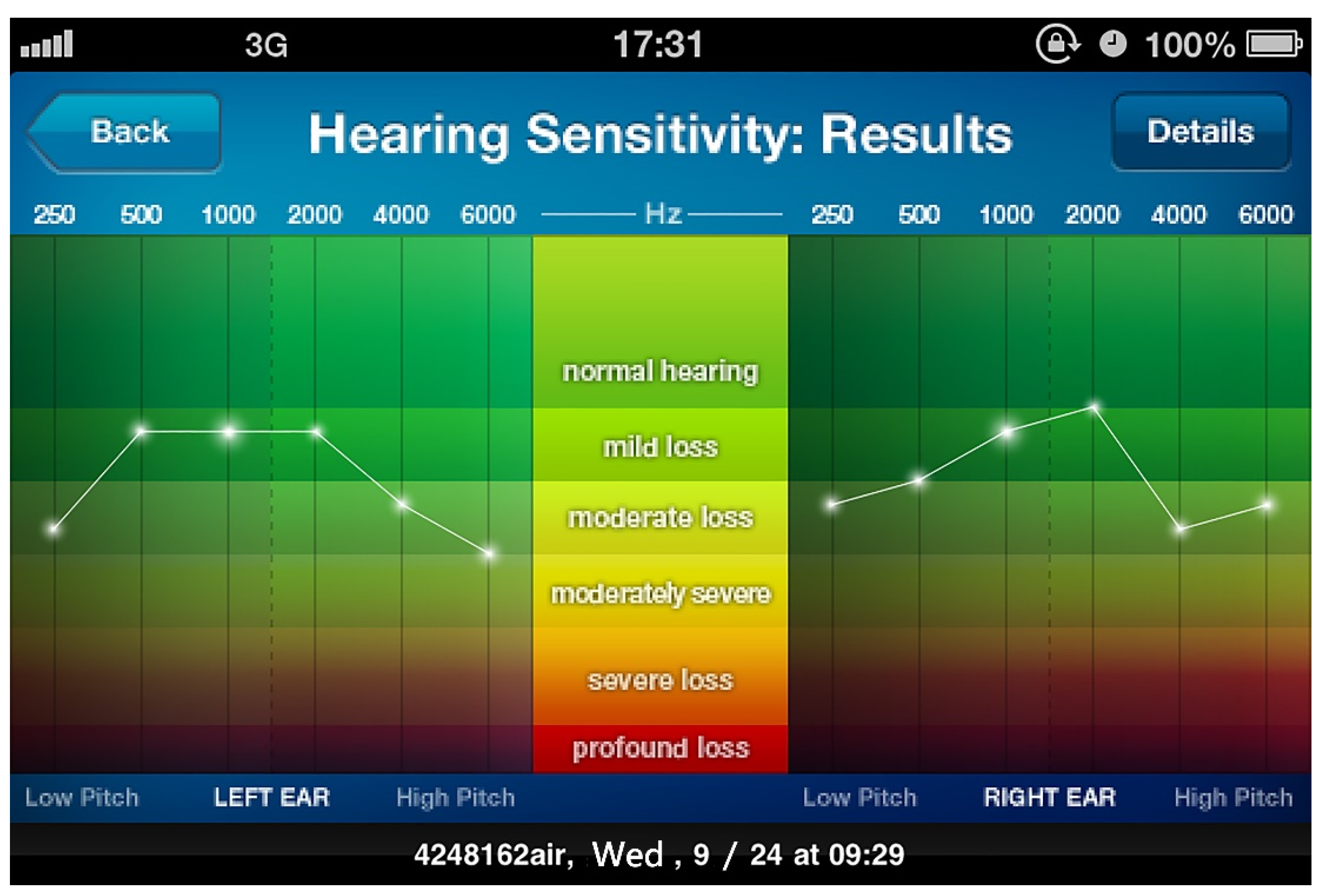 JPM Free Full Text Validation Of A Personalized Hearing Screening JPM Free Full Text Validation Of A Personalized Hearing Screening