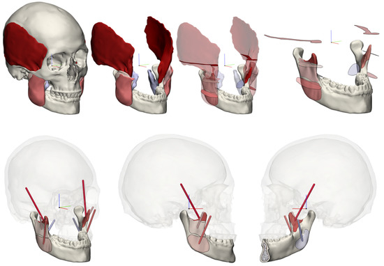 A Contemporary Approach to Non-Invasive 3D Determination of Individual ...