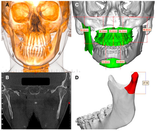 An Overview of Clinical Conditions and a Systematic Review of ...