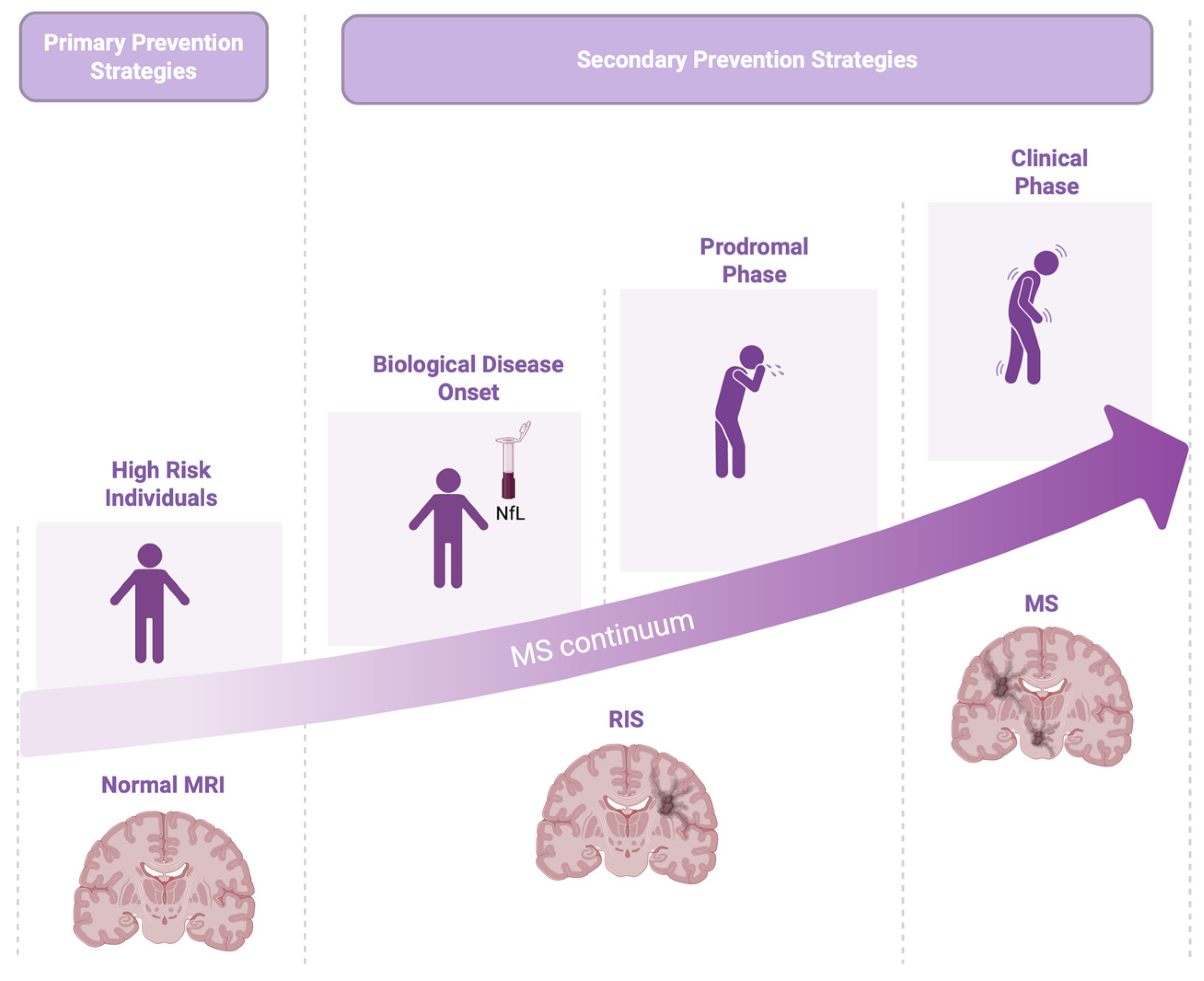 Anticipating Clinical Onset in Multiple Sclerosis: Challenges and ...