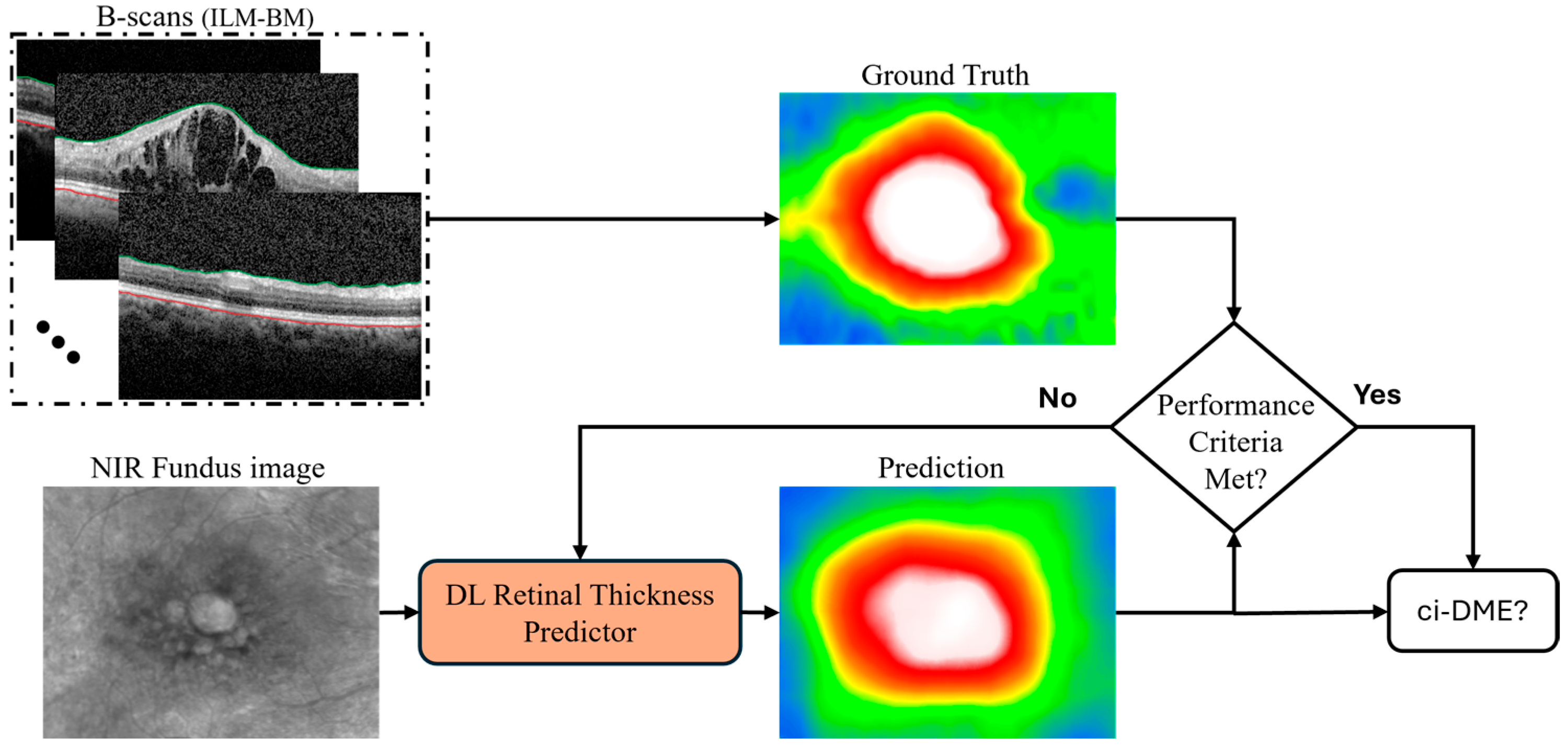 Deep Learning Prediction of Retinal Thickness from Near-Infrared Fundus ...