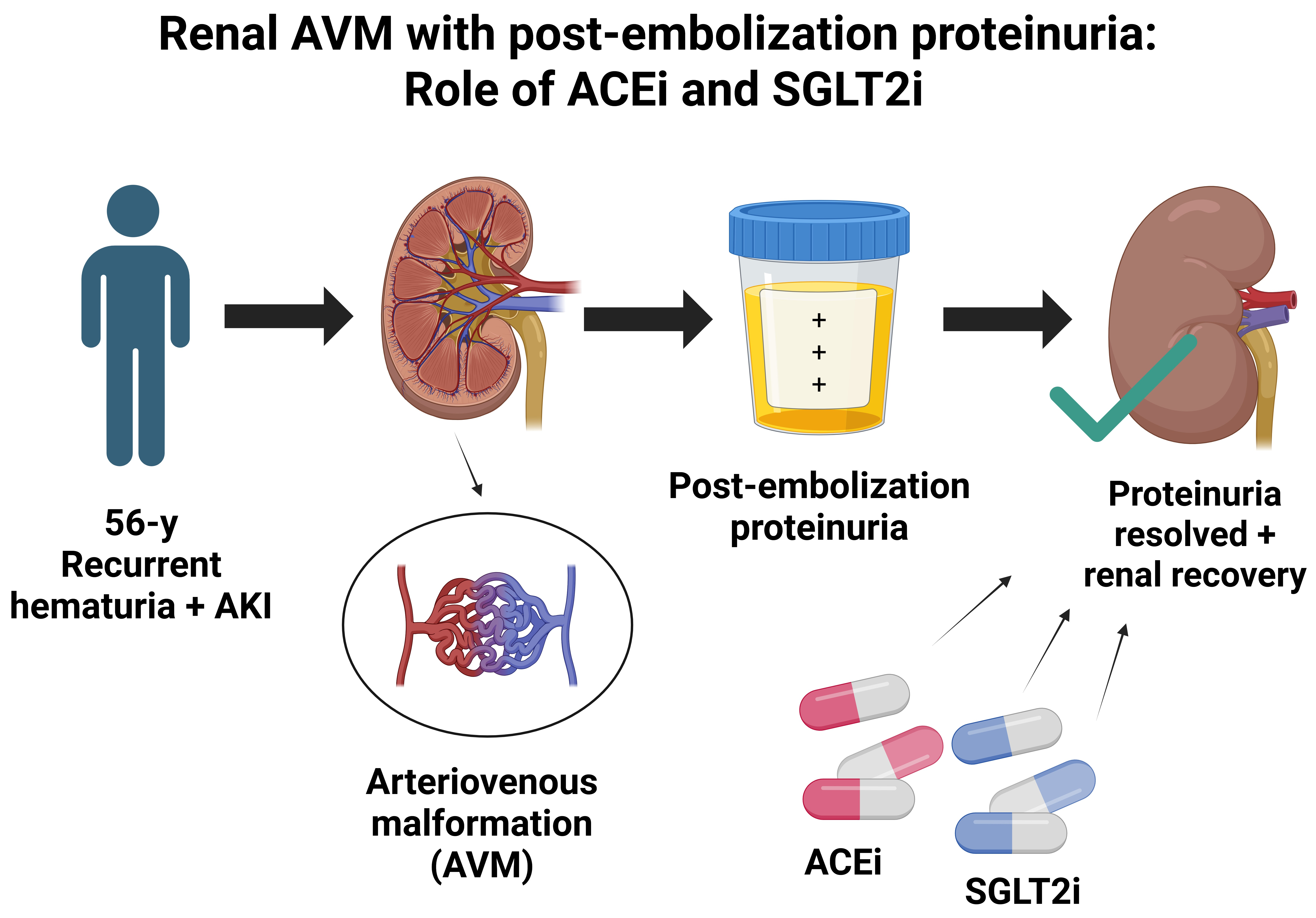 Resolution of Proteinuria After Renal AVM Embolization with Combined ...