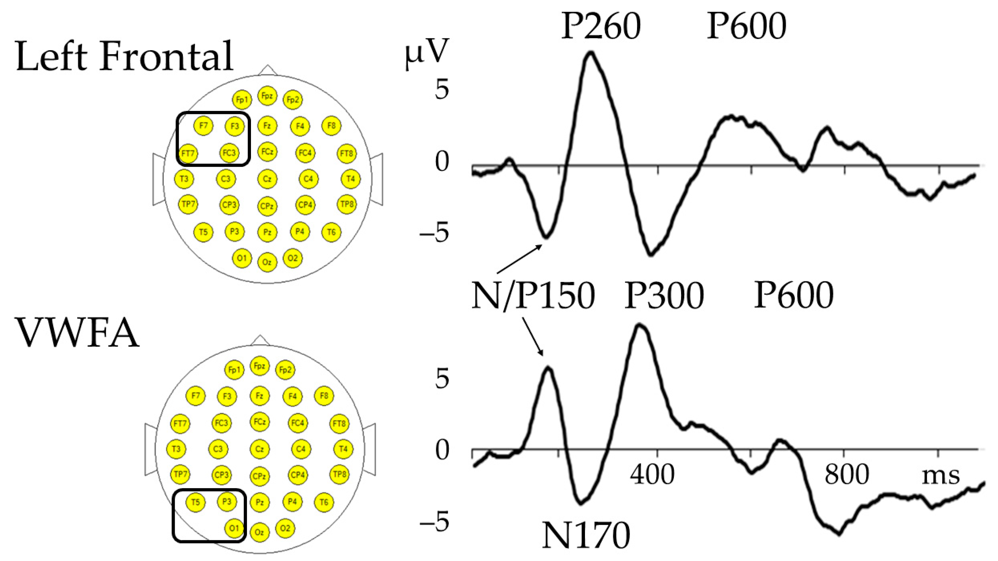 Print Exposure Interaction with Neural Tuning on Letter/Non-Letter ...