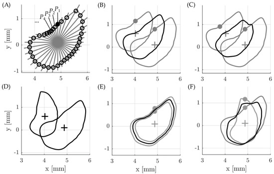 Uncoiling the Human Cochlea—Physical Scala Tympani Models to Study ...