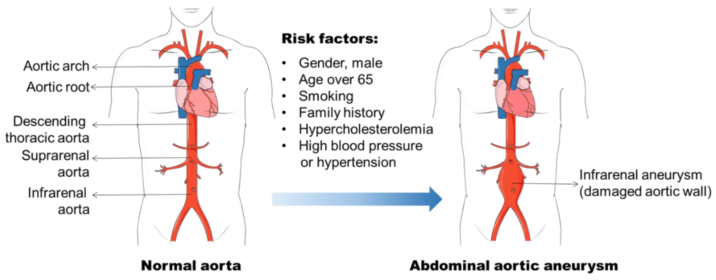 Stomach Aorta Stomach Aorta
