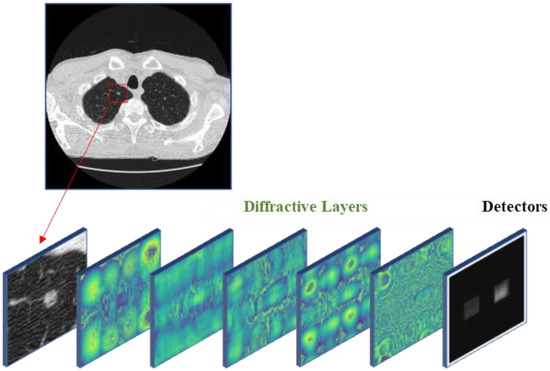 Pulmonary Nodule Detection and Classification Using All-Optical Deep ...