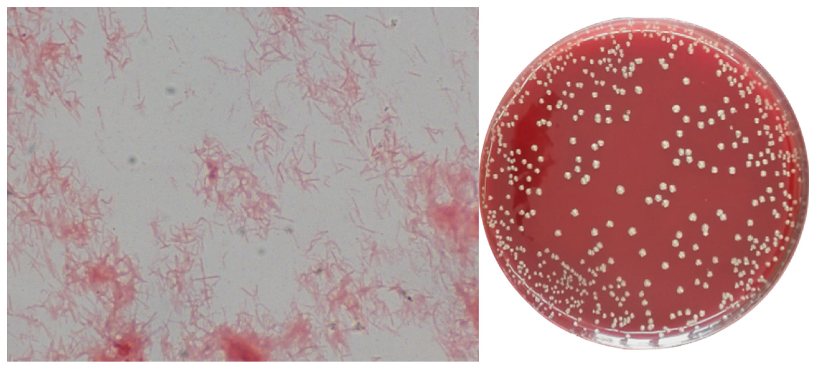 Obtaining Muramic Acid from Staphylococcus aureus: A Simple Strategy ...