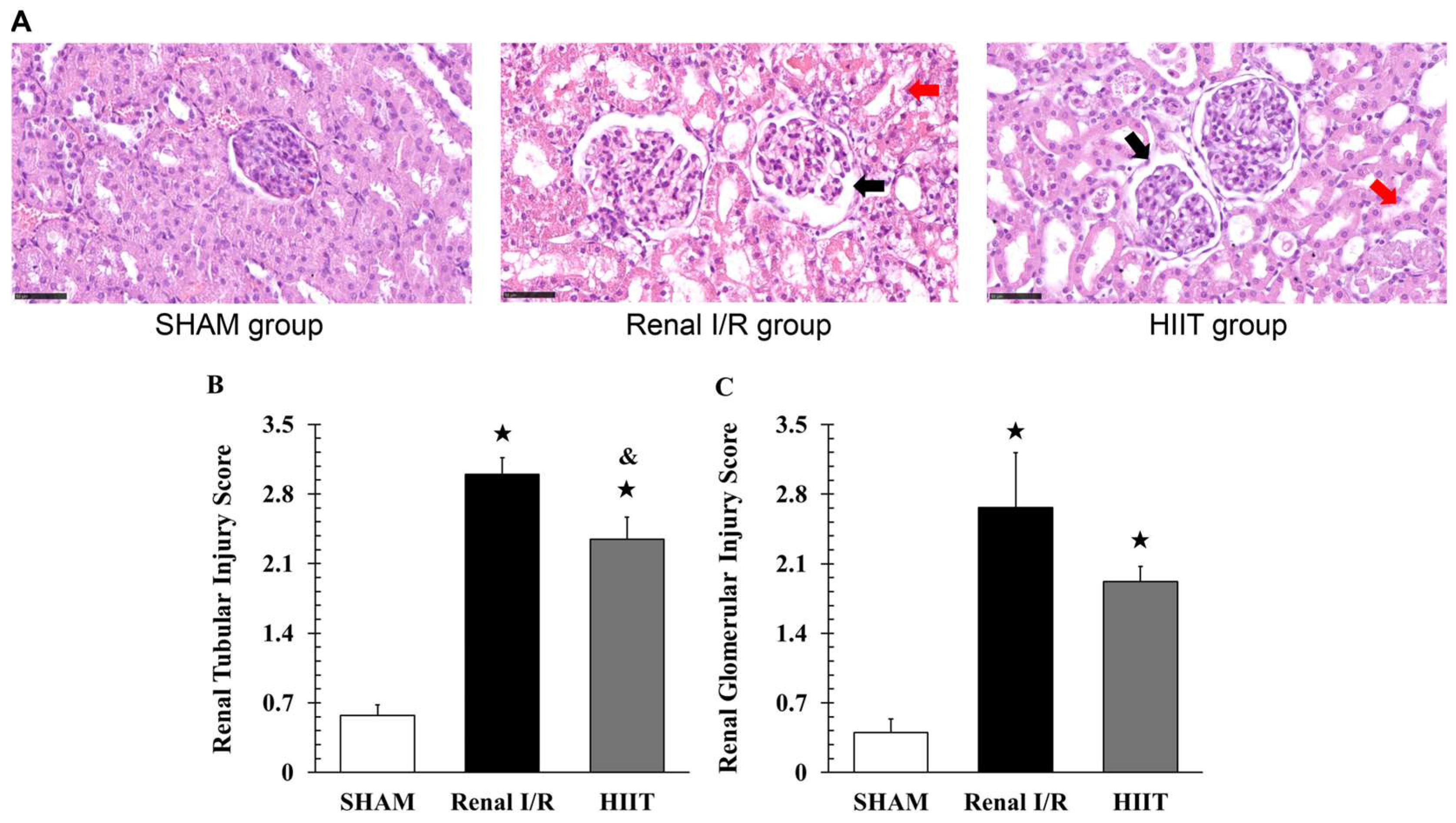 High-Intensity Interval Training Attenuates Inflammation in Cardiorenal ...
