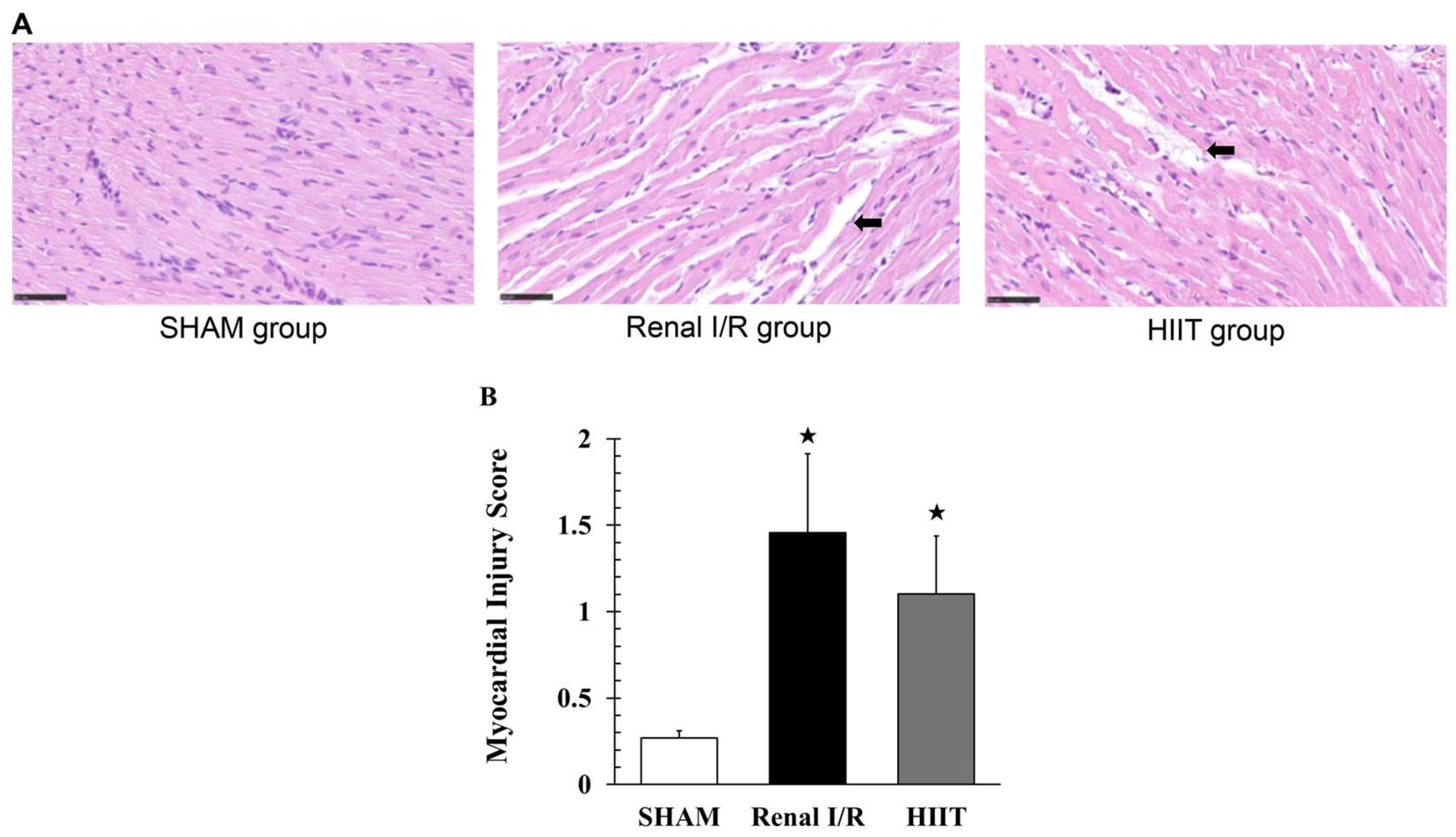 High-Intensity Interval Training Attenuates Inflammation in Cardiorenal ...