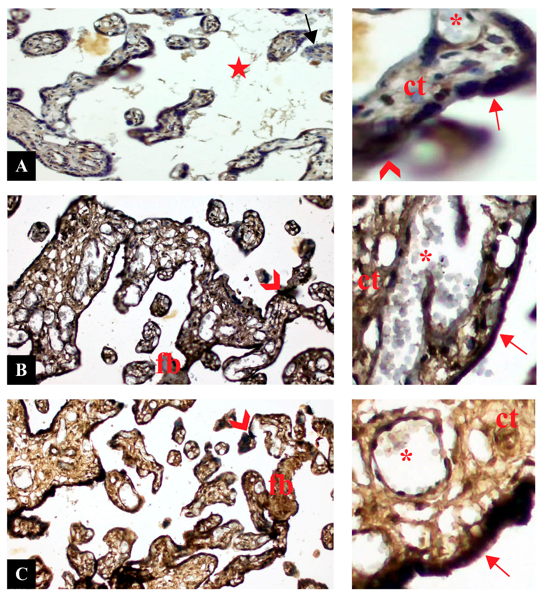 NRF1 and NRF2 Expression in Preeclamptic Placentas: A Comparative ...