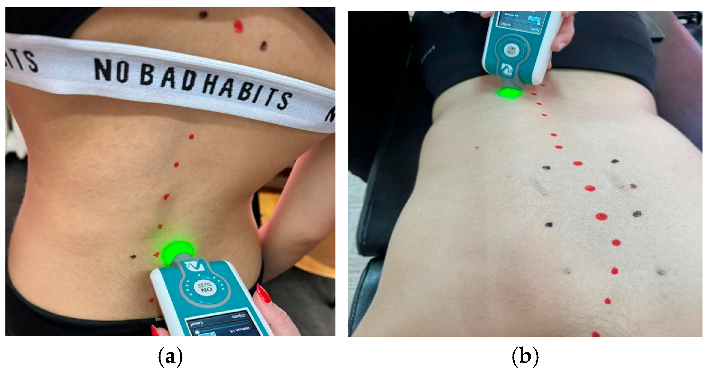 Myotonometric, Static Plantar Pressure, and Stabilometric Assessment in ...